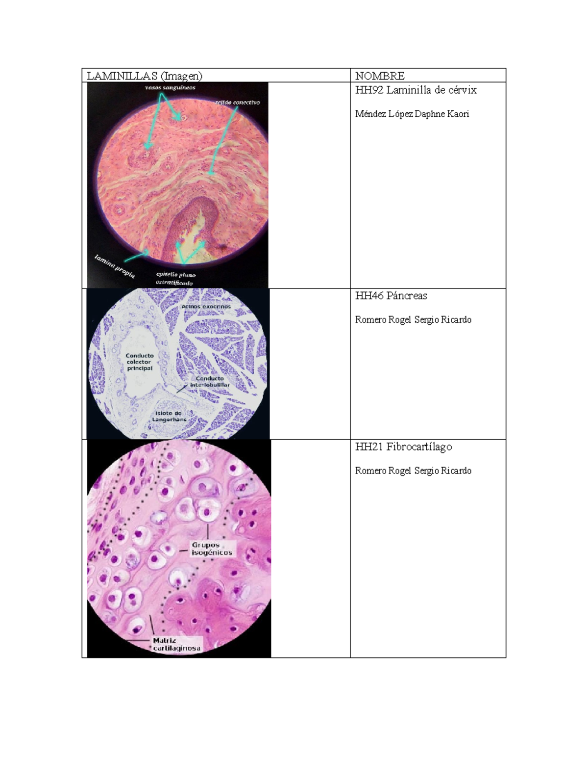 Laminillas 1020 - LAMINILLAS (Imagen) NOMBRE HH92 Laminilla de cérvix ...