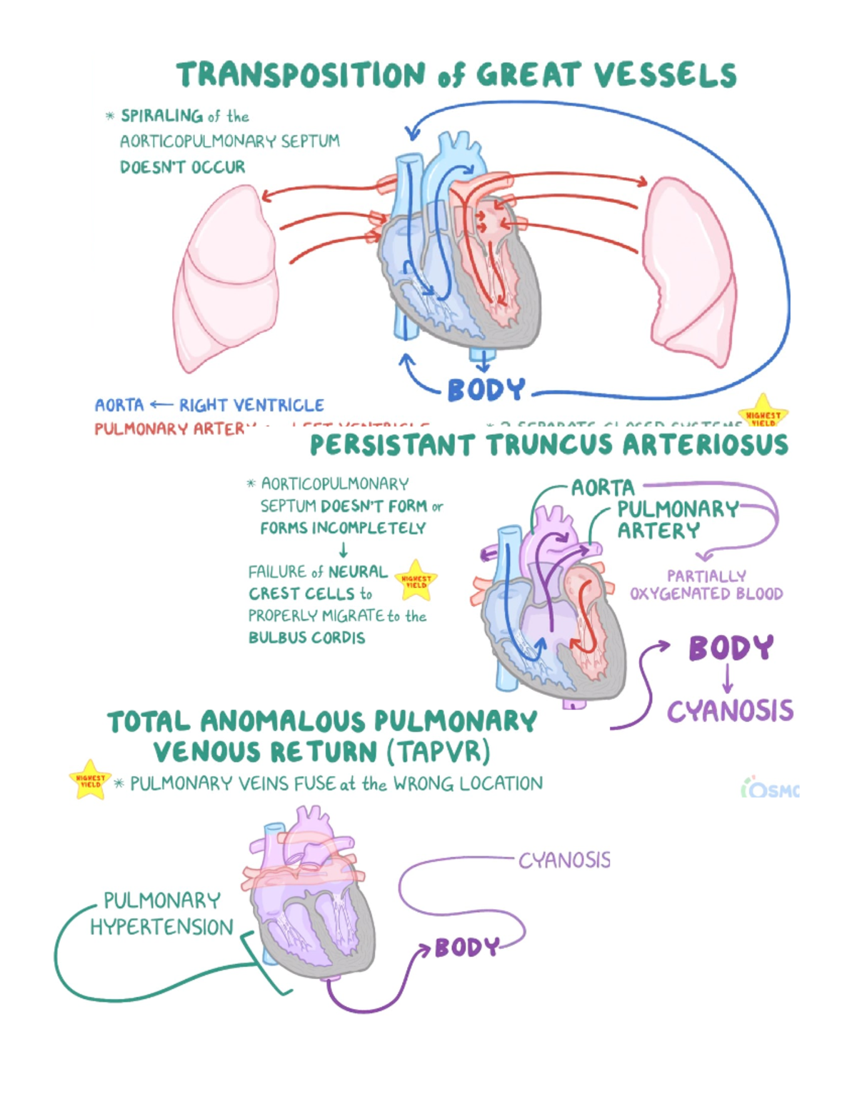 Pediatric heart defects graphics - PNV1714 - Studocu