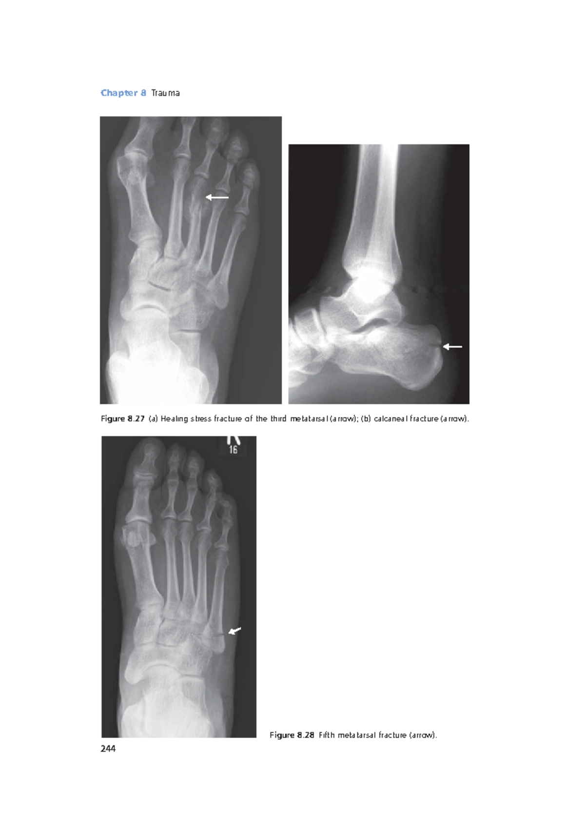 Radiology Lecture Notes pdf (82) - Chapter 8 Trauma 244 Figure 8 (a ...
