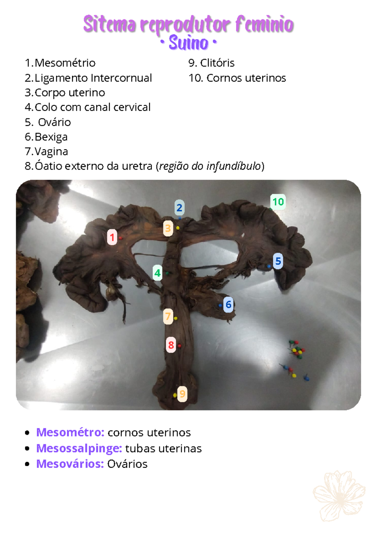 Sistema reprodutor 20240619 111351 0000 - 1étrio 2. Ligamento ...