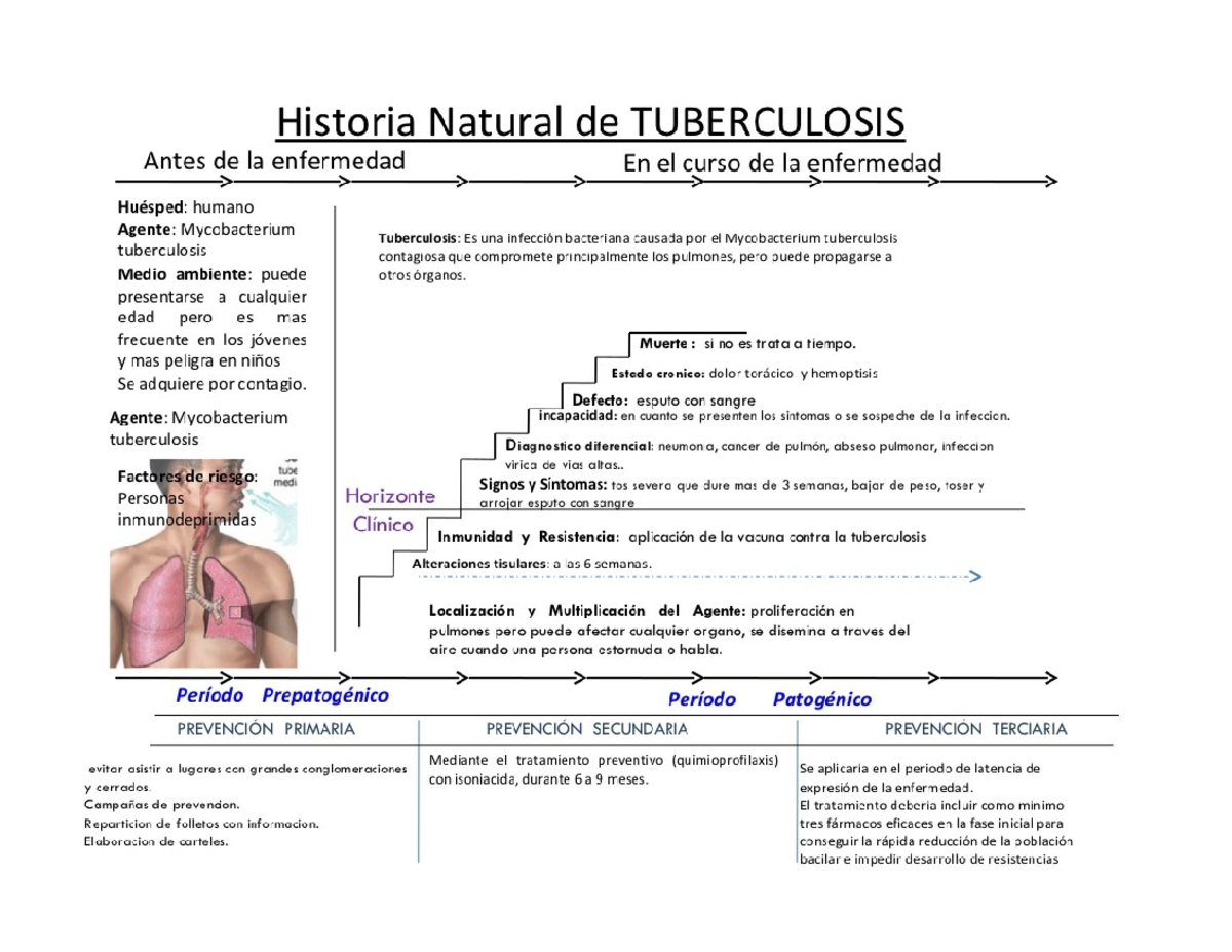 Ejemplo HNE - Tuberculosis historia natural de la enfermedad - Historia ...