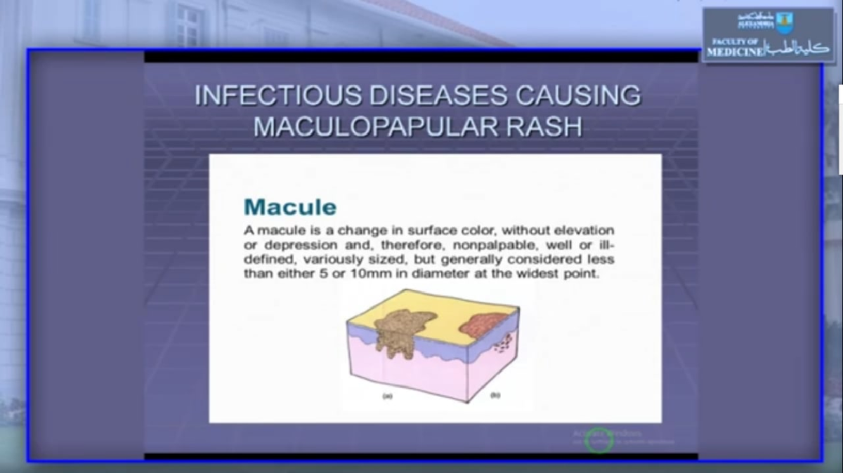 5.infectious-diseases-causing-maculopapular-rash.pdf - Medical - Studocu