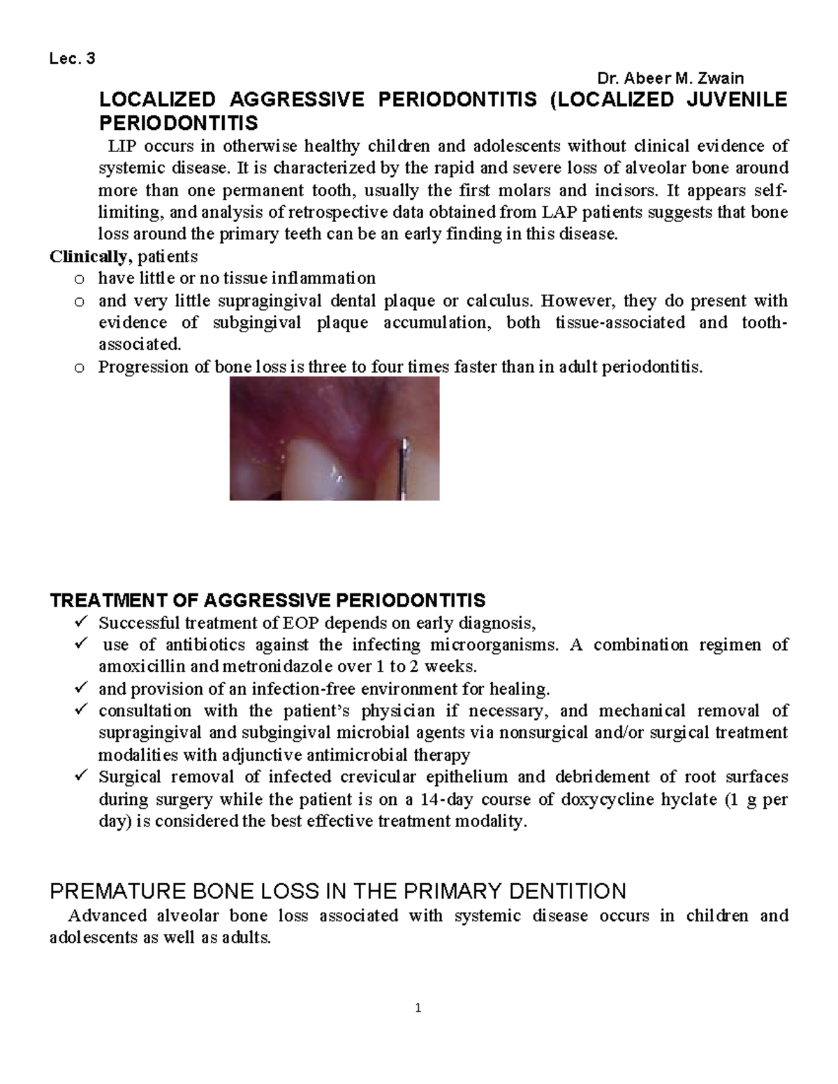 Ging - Orthodontic - Lec. 3 Dr. Abeer M. Zwain LOCALIZED AGGRESSIVE ...