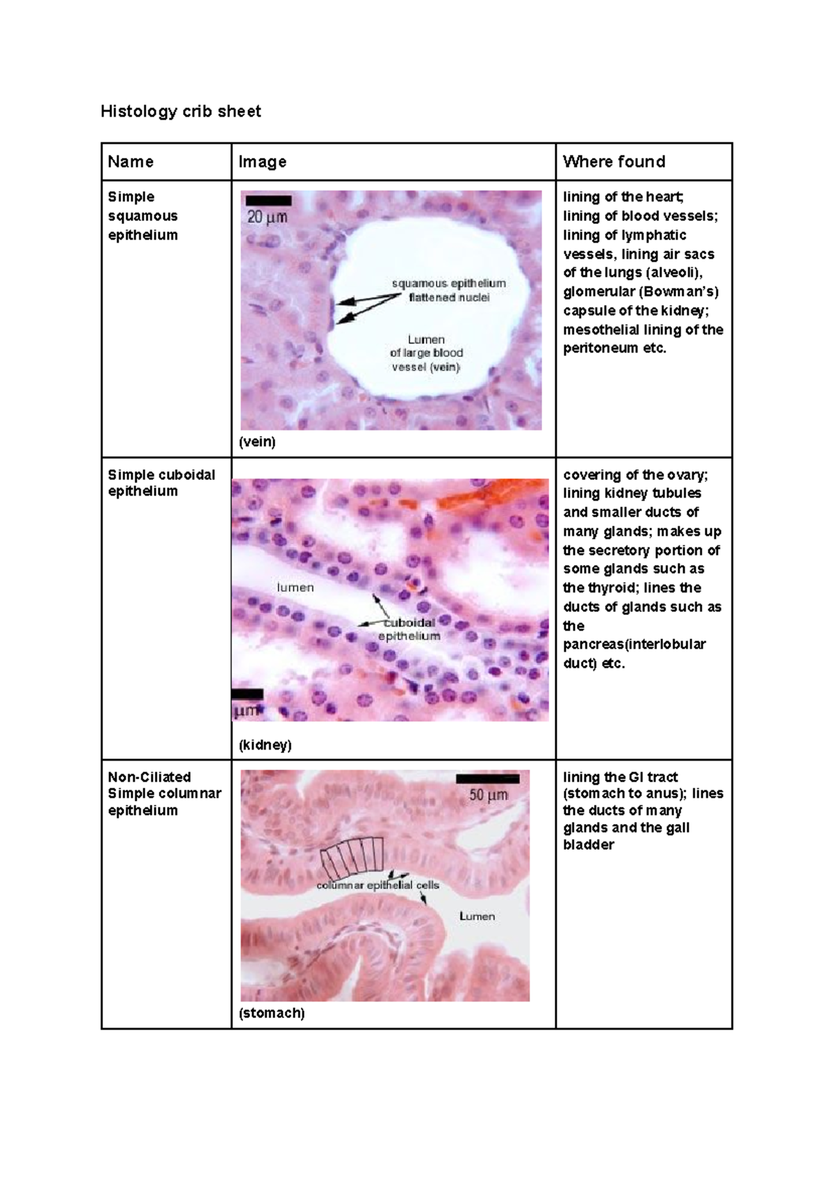 Histology and tissue recognition - Histology crib sheet Name Image ...