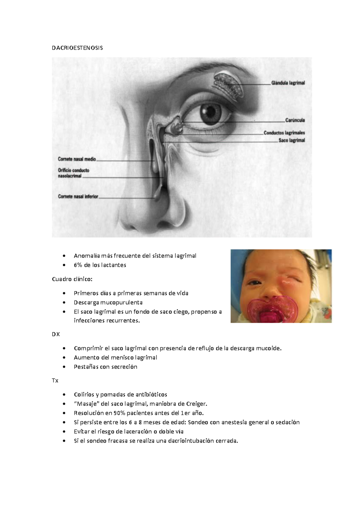 Dacrioestenosis - Resumen, oftamoligía - DACRIOESTENOSIS Anomalía más ...