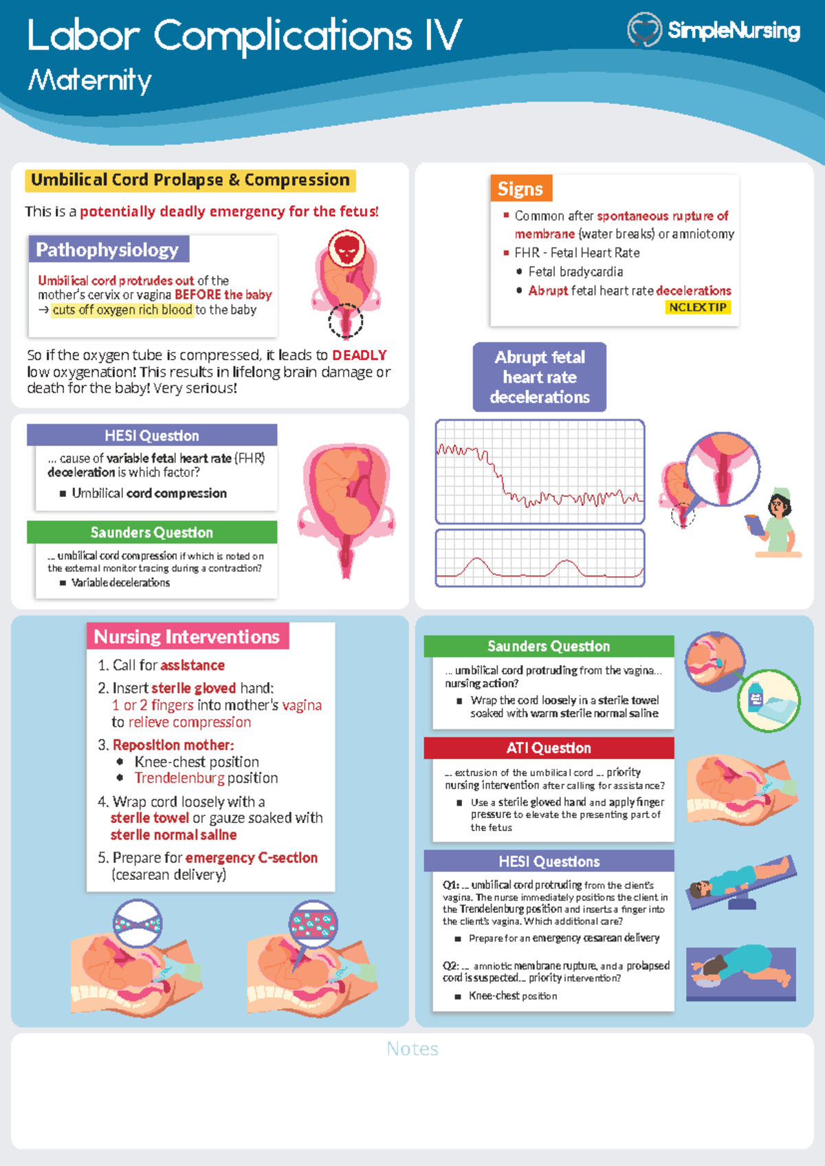 4 - Umbilical Cord Prolapse & Compression - Labor Complications IV ...