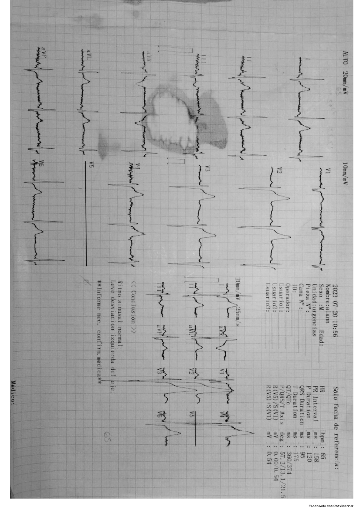 Electrocardiograma - electro - AUTO 65 10:56 Sólo fecha de referencia ...