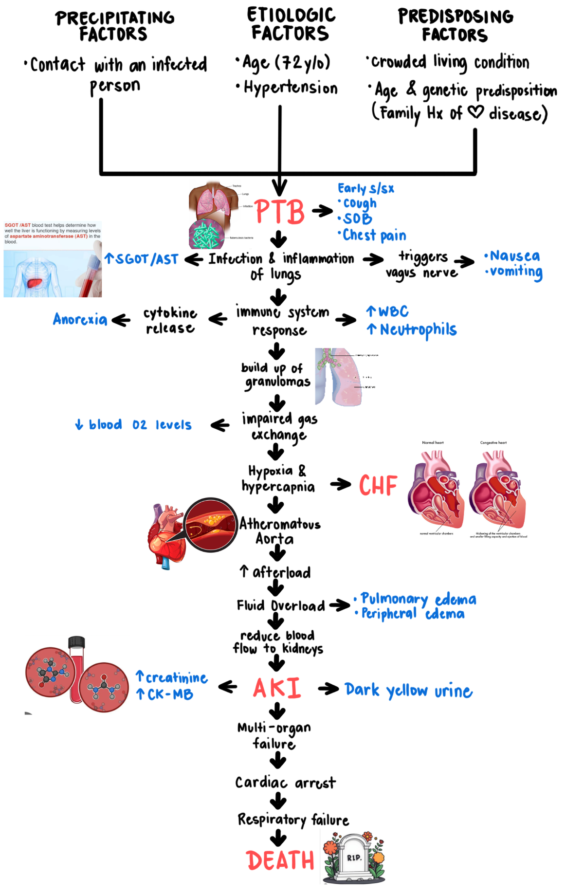 Pathophysiology PTB/CHF/SEPSIS - PRECIPITATING ETIOLOGIC PREDISPOSING ...