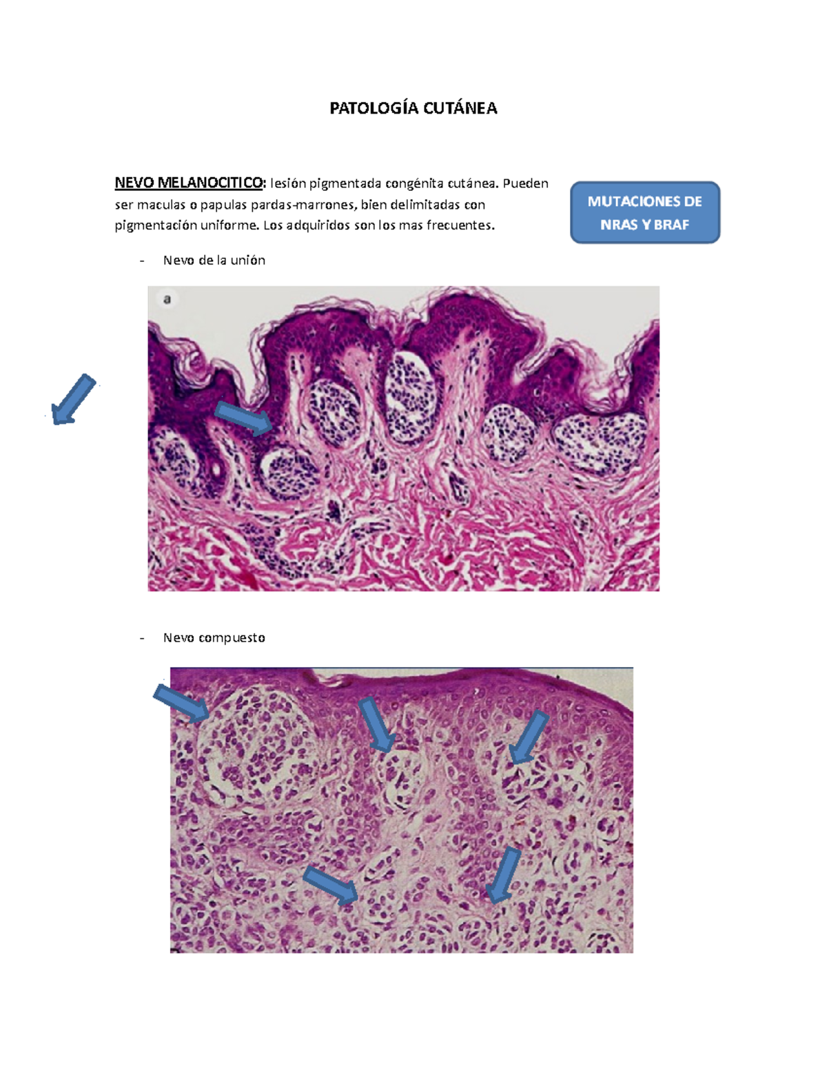 Patología Cutánea - mnbhgh - PATOLOGÍA CUTÁNEA NEVO MELANOCITICO: lesión pigmentada congénita ...