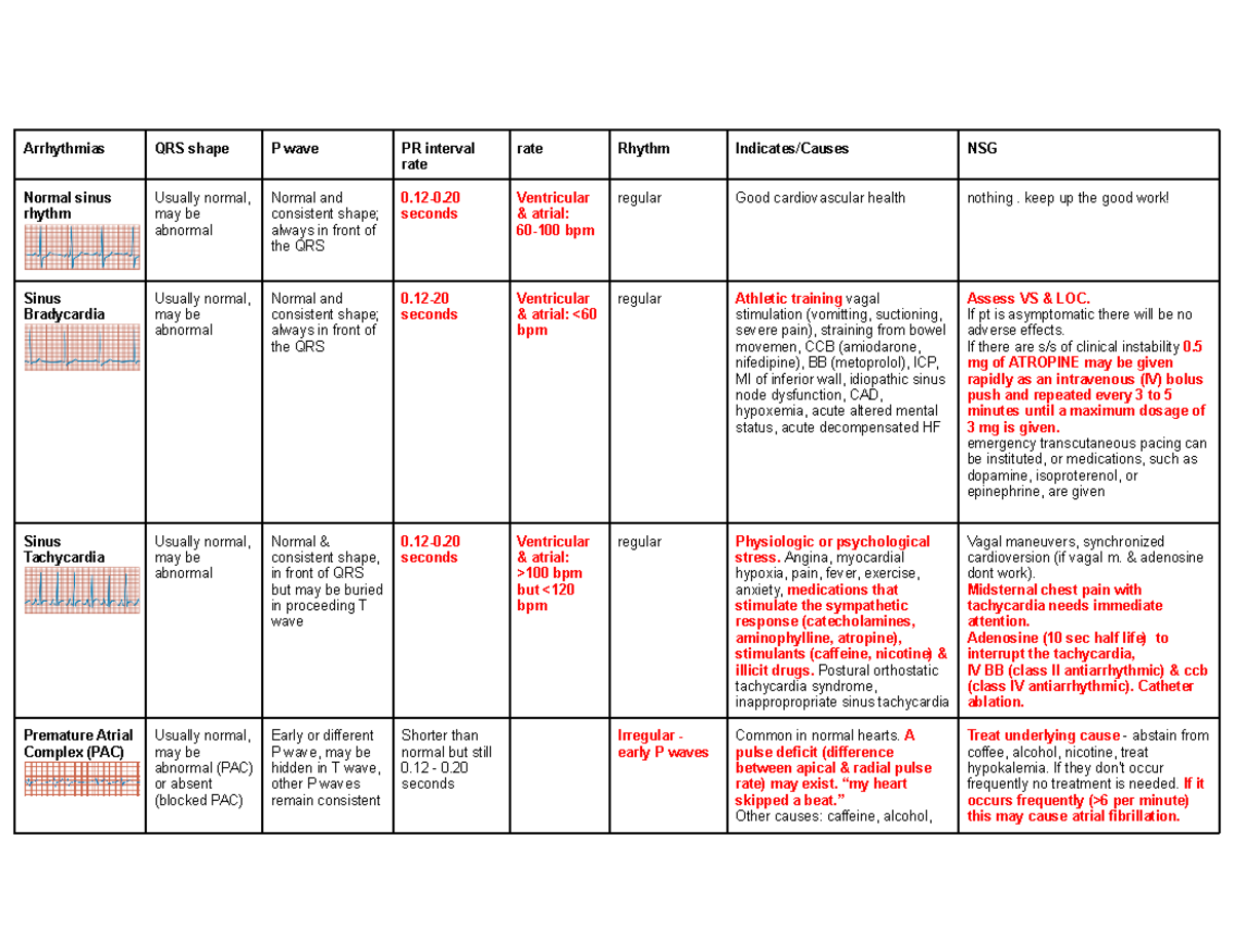 Exam 1 medsurg chart arrythmias - Arrhythmias QRS shape P wave PR ...