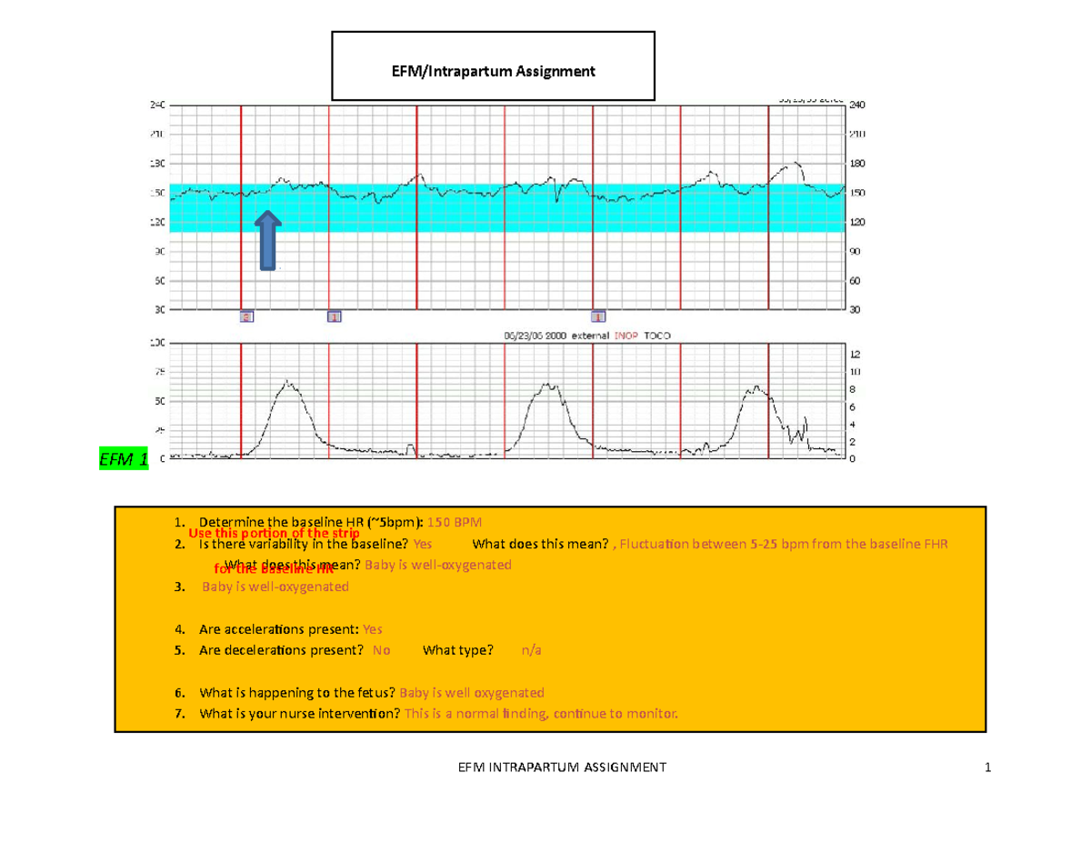EFM Strip Assignment 1 for OB/GYN mother baby - EFM 1 Determine the ...