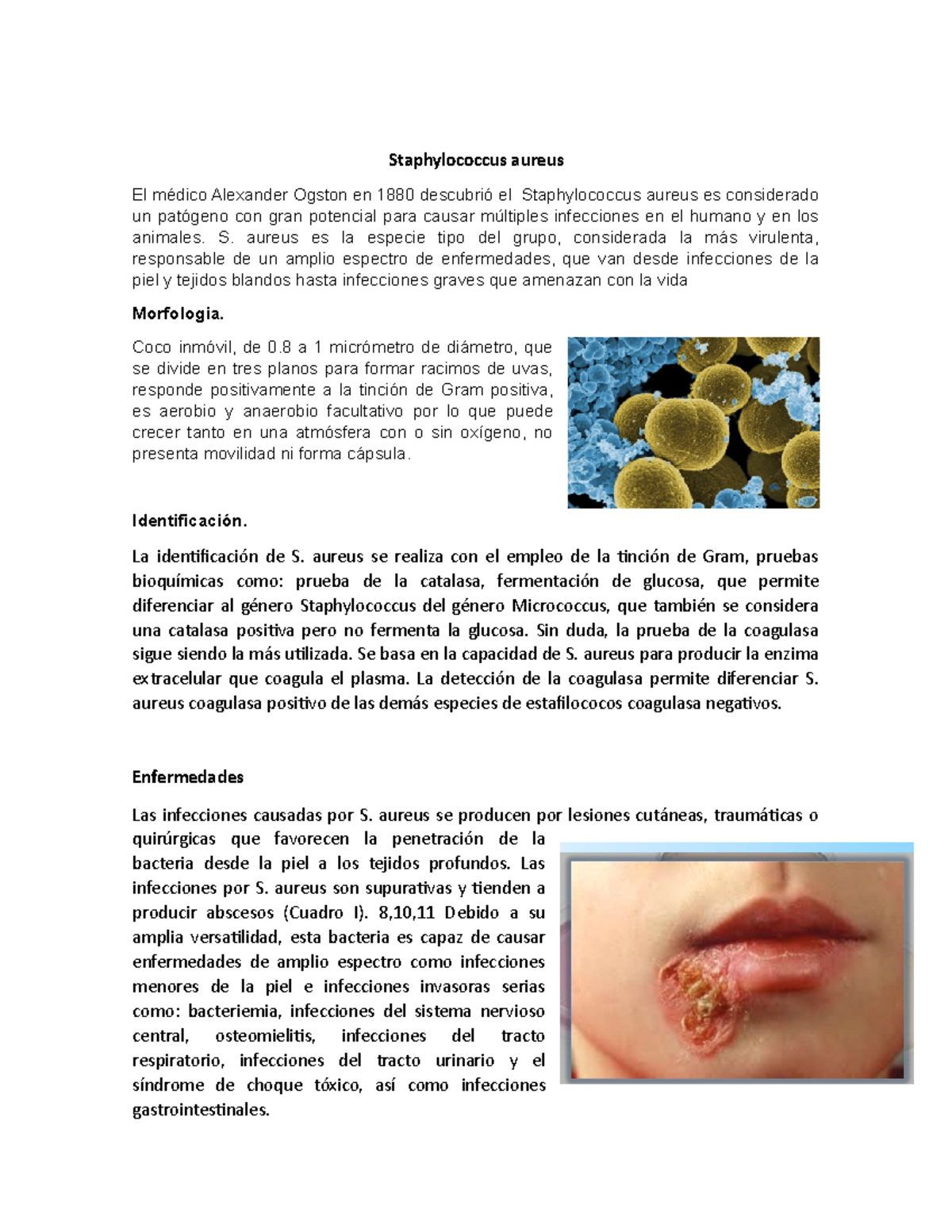 Staphylococcus aureus y Clostridium prenfings - Staphylococcus aureus ...