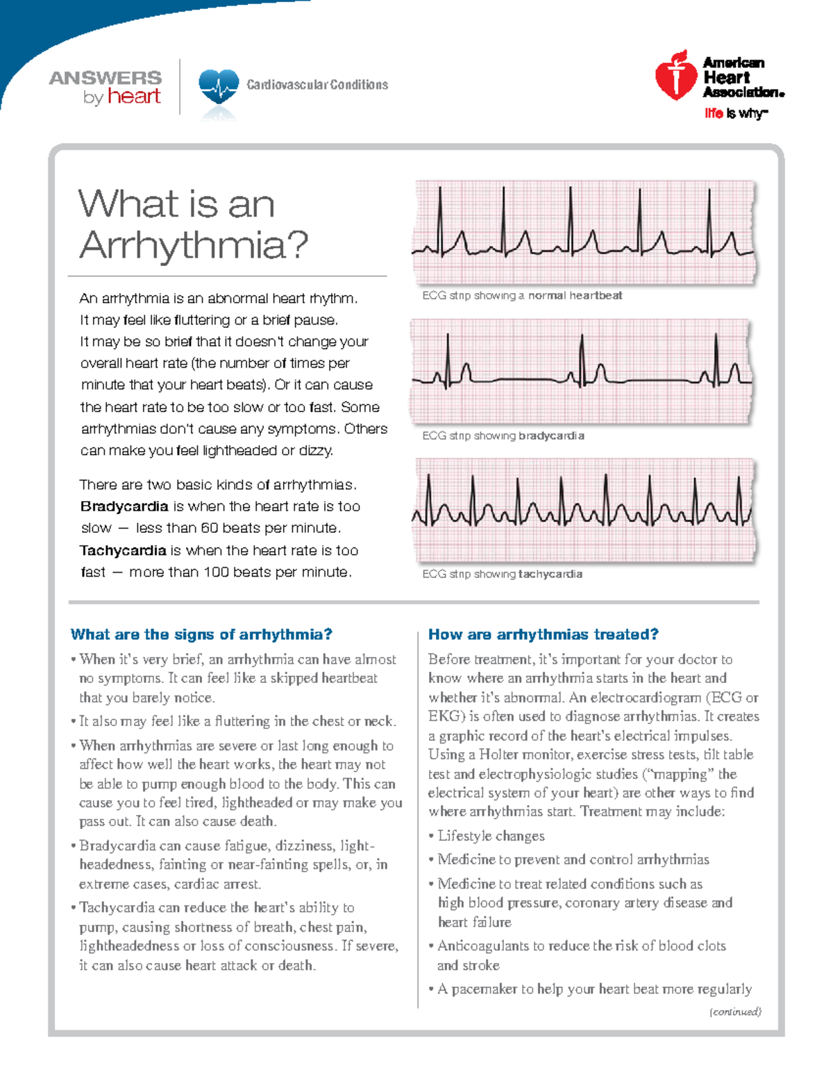 What is Arrhythmia - (continued) ANSWERS by heart What are the signs of ...