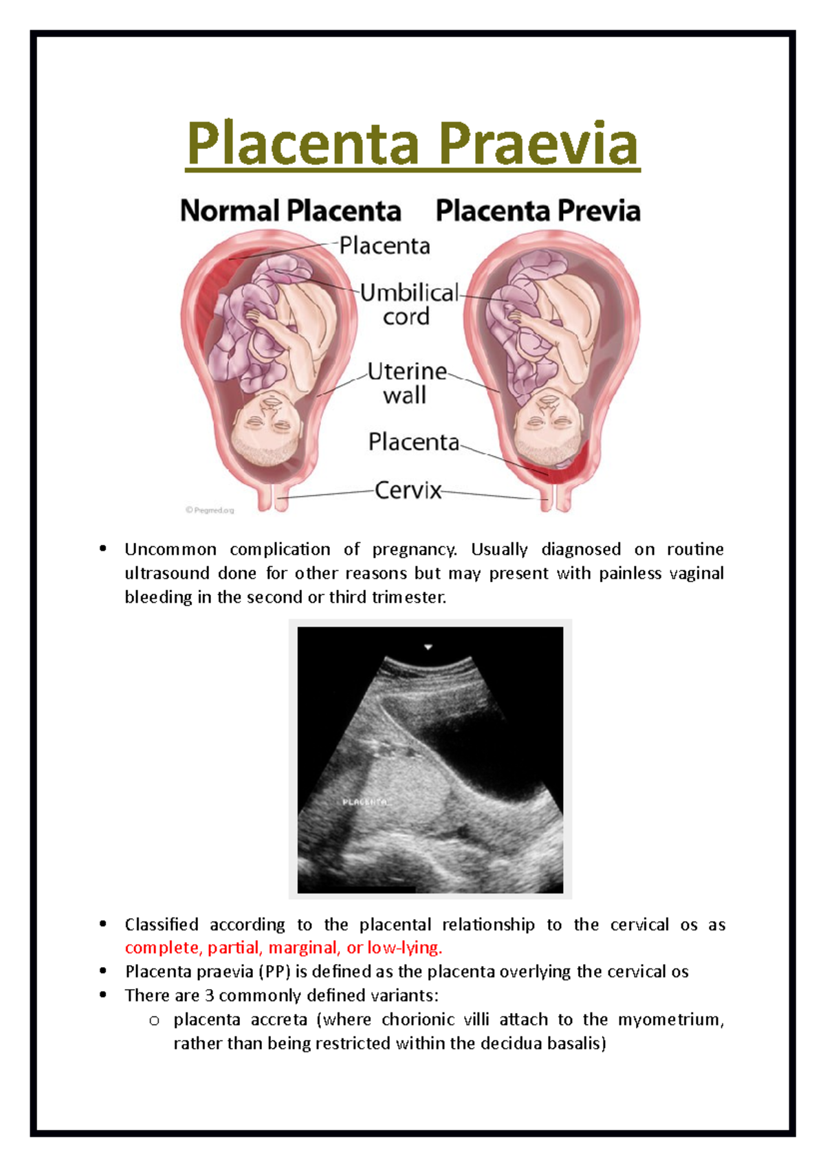 Placenta Praevia - Obstetrics - Placenta Praevia Uncommon complication ...