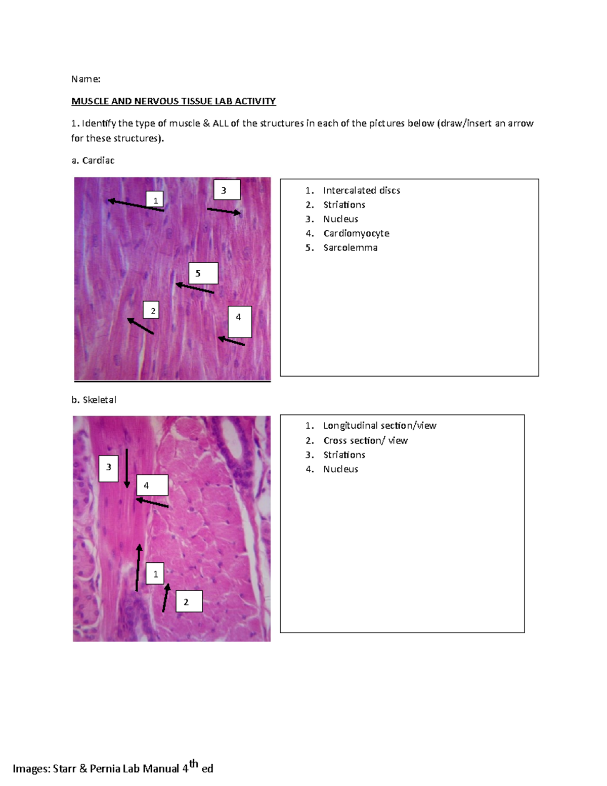 Muscle and Nervous Lab Activity - Name: MUSCLE AND NERVOUS TISSUE LAB ...