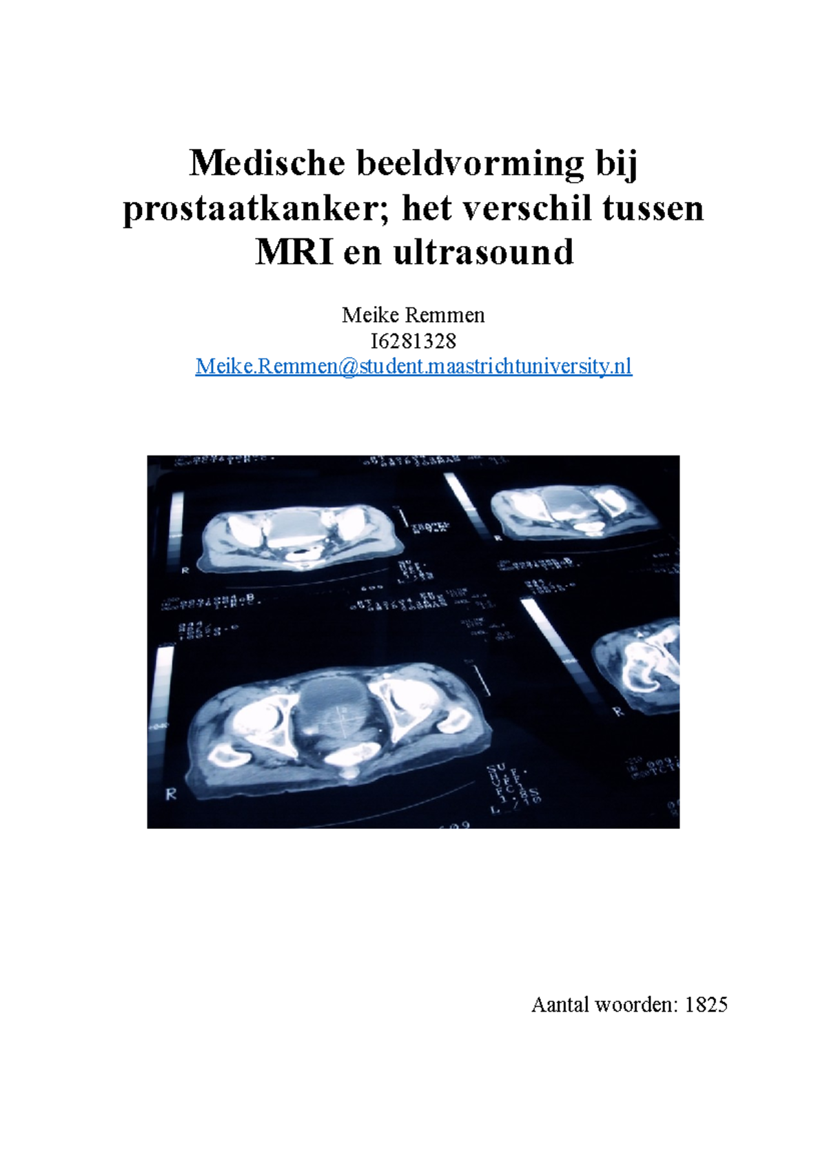 werkstuk beeldvormende technieken prostaat kanker - Medische ...