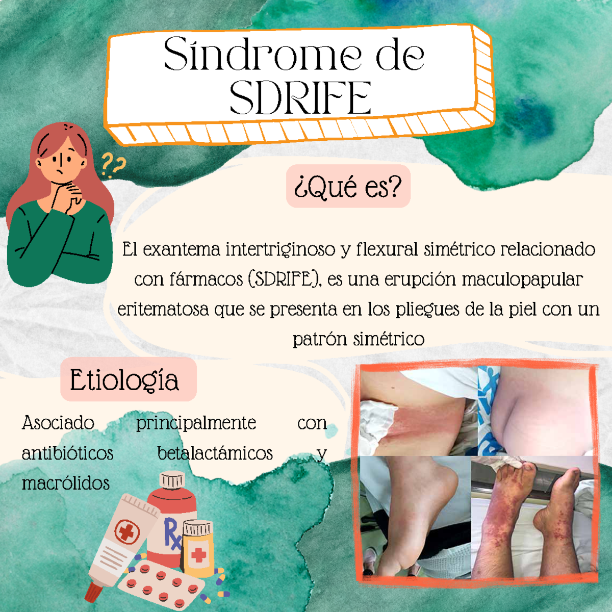SDRIFE dermatología - El exantema intertriginoso y flexural simétrico ...
