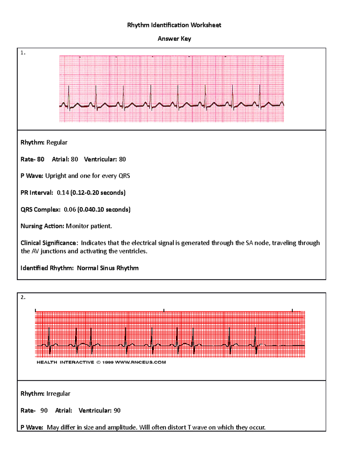 Motor Rhythm Explained At Harold Hernandez Blog