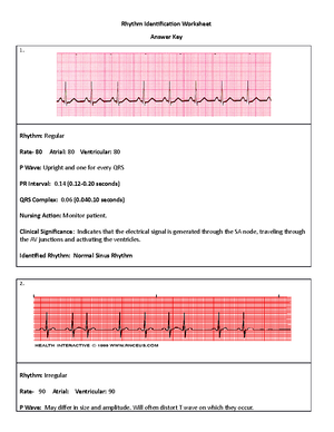 MS,MG,GBS Table - jgj - MULTIPLE SCLEROSIS MYASTHENIA GRAVIS GUILLIAN-BARRE SYNDROME MS is an ...
