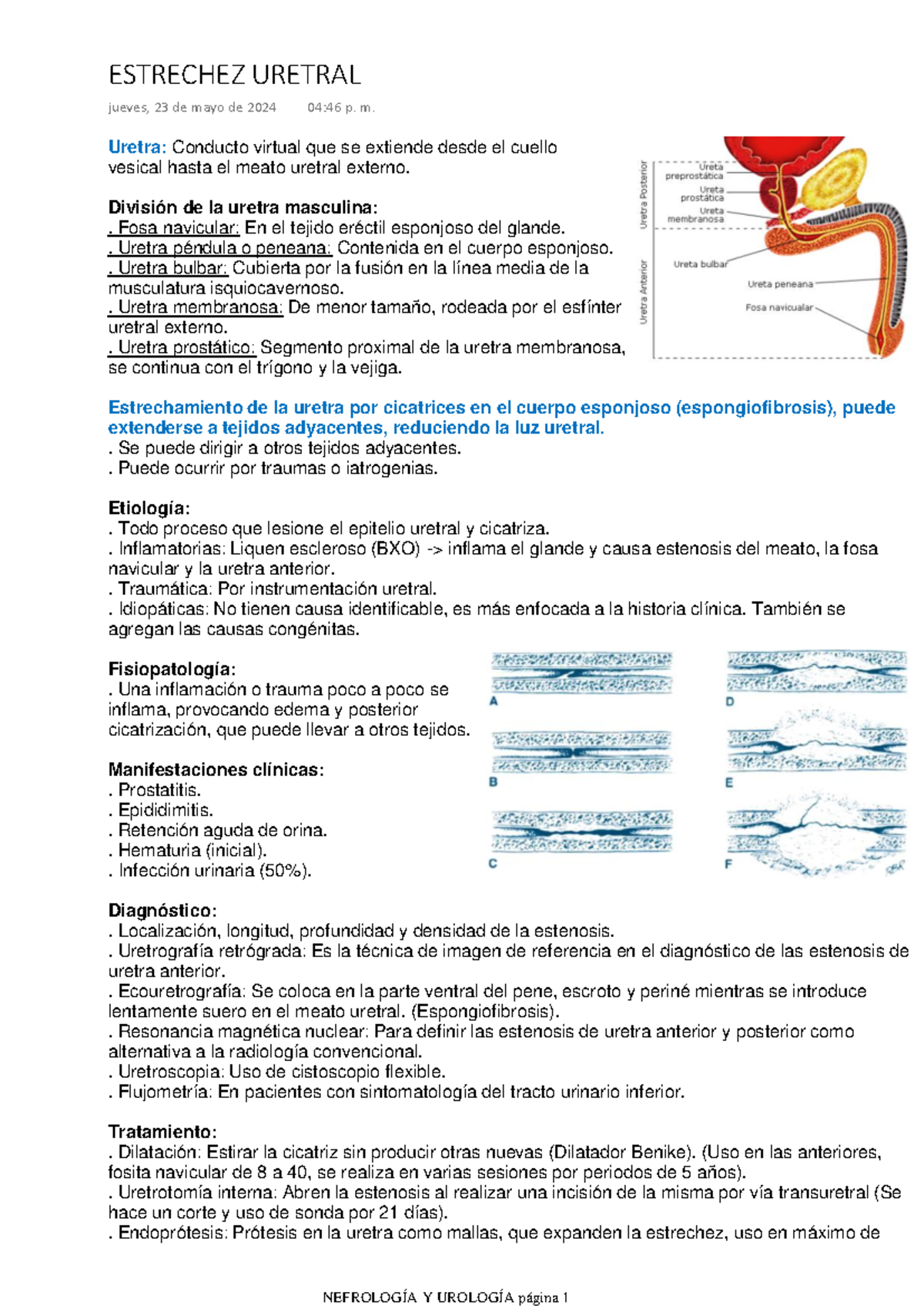 14- Estrechez Uretral - Uretra: Conducto virtual que se extiende desde ...
