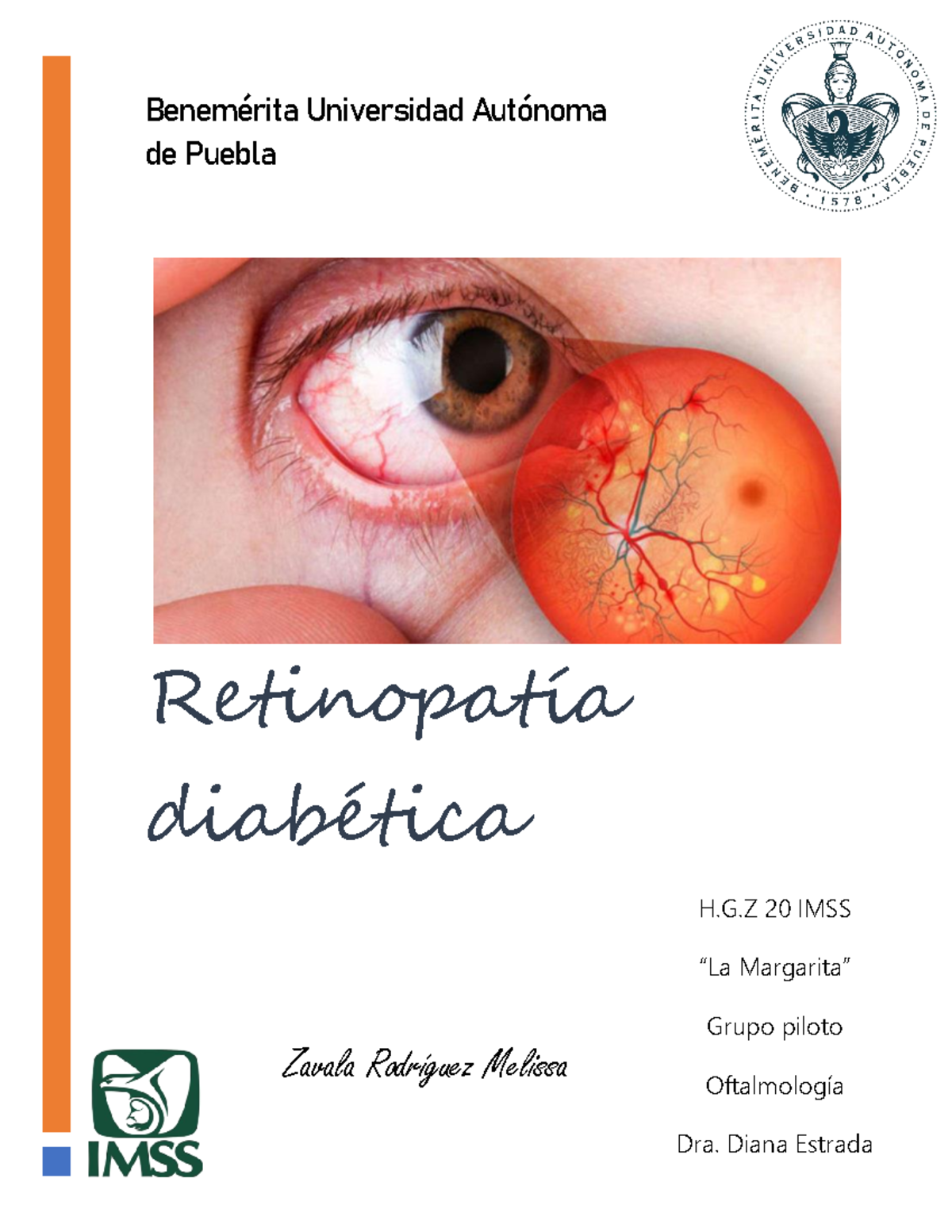 Retinopatia Diabetica - Warning: TT: undefined function: 3 Warning: TT: undefined function: 3 ...