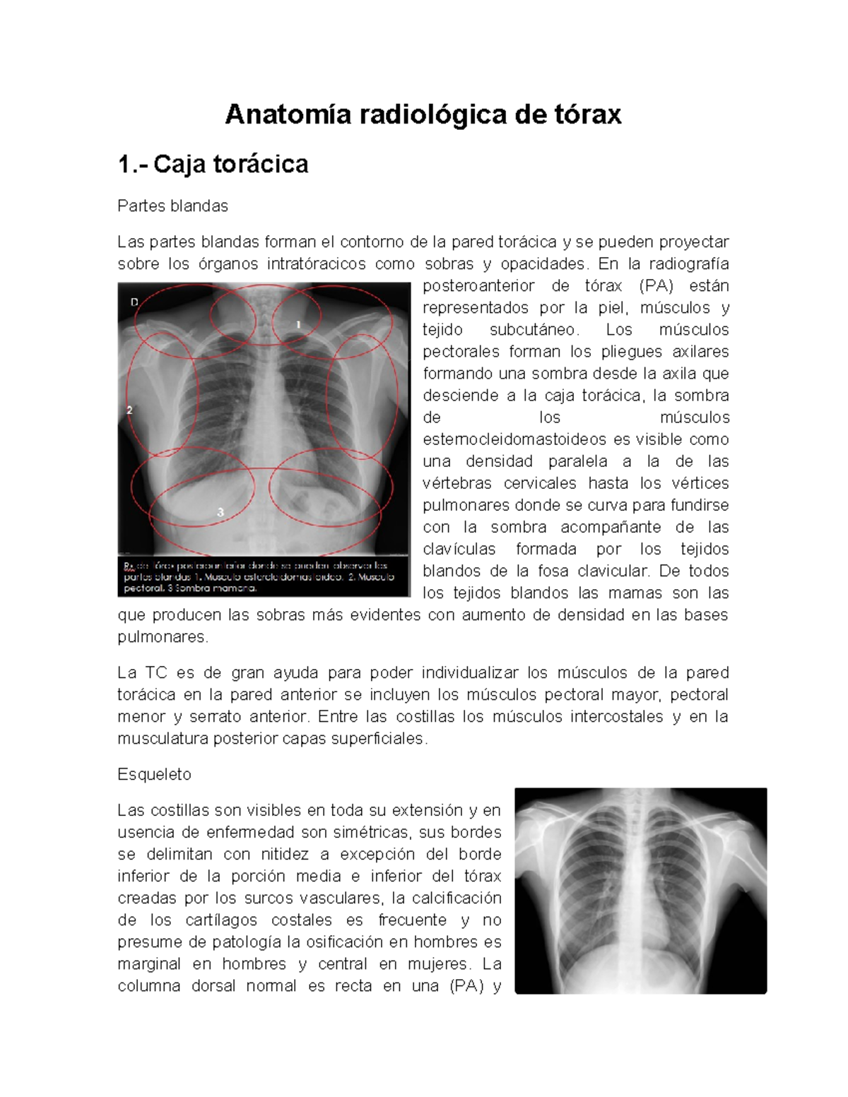 Anatomía radiológica de tórax resumen - Anatomía radiológica de tórax 1 ...