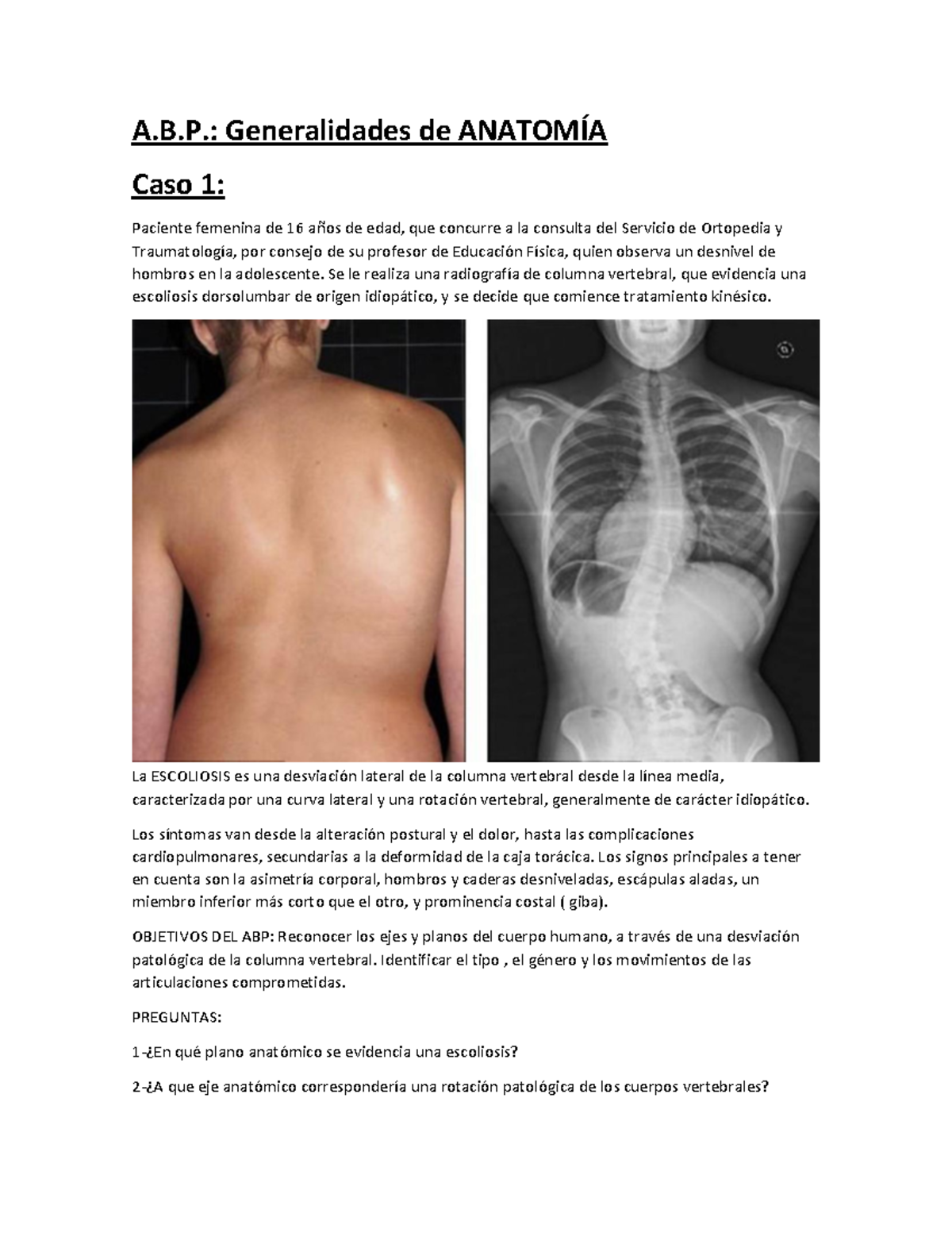 ABP-Generalidades - ABP-Generalidades - Warning: TT: undefined function: 32 A.B.: Generalidades ...