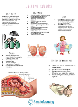 Maternity nursing key concepts - Maternity key concepts Antepartum ...