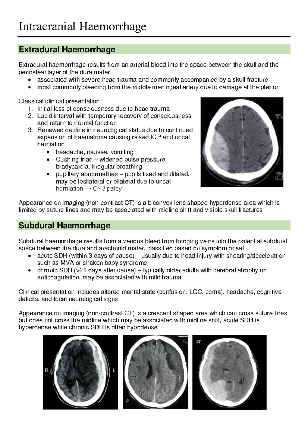 Intracranial Haemorrhage - Intracranial Haemorrhage Extradural ...