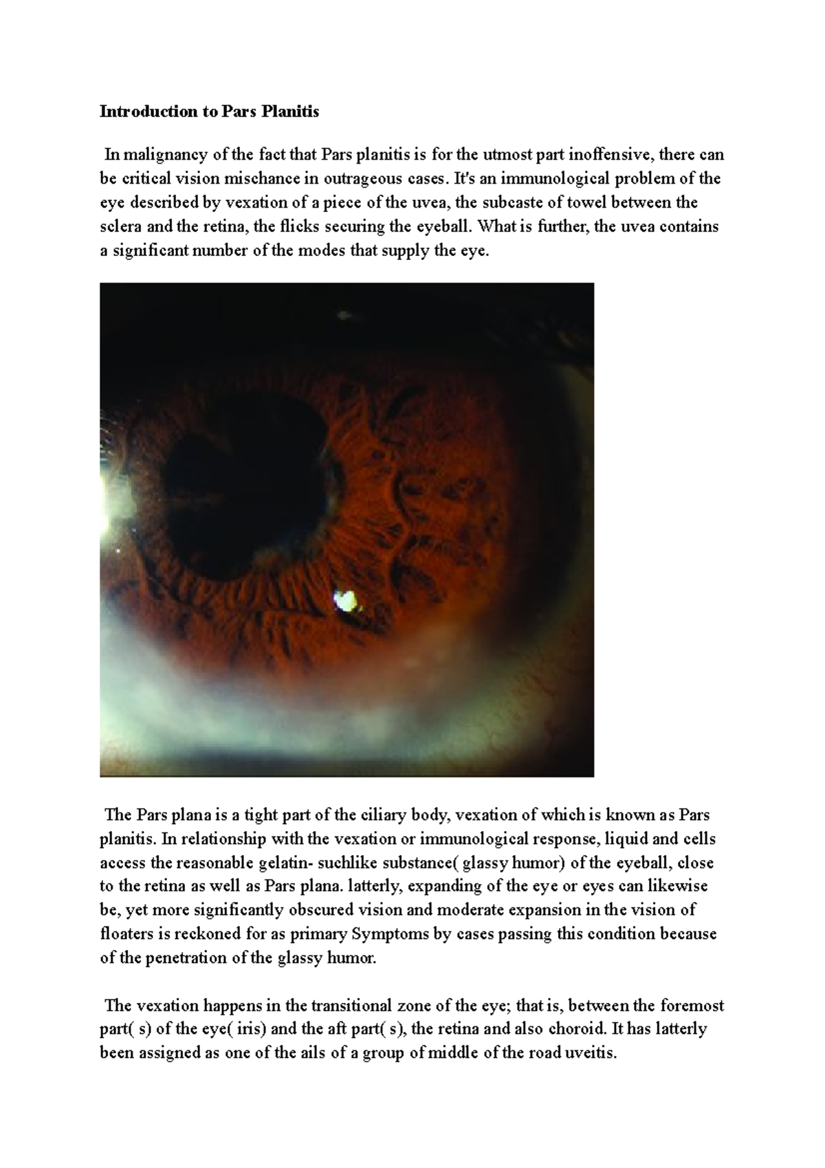 Pars Planitis - It's an immunological problem of the eye described by ...