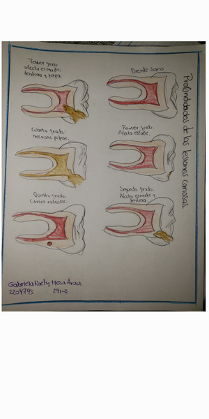 Guía prope - Una guía de estudio del 3er parcial(Profilaxis ...