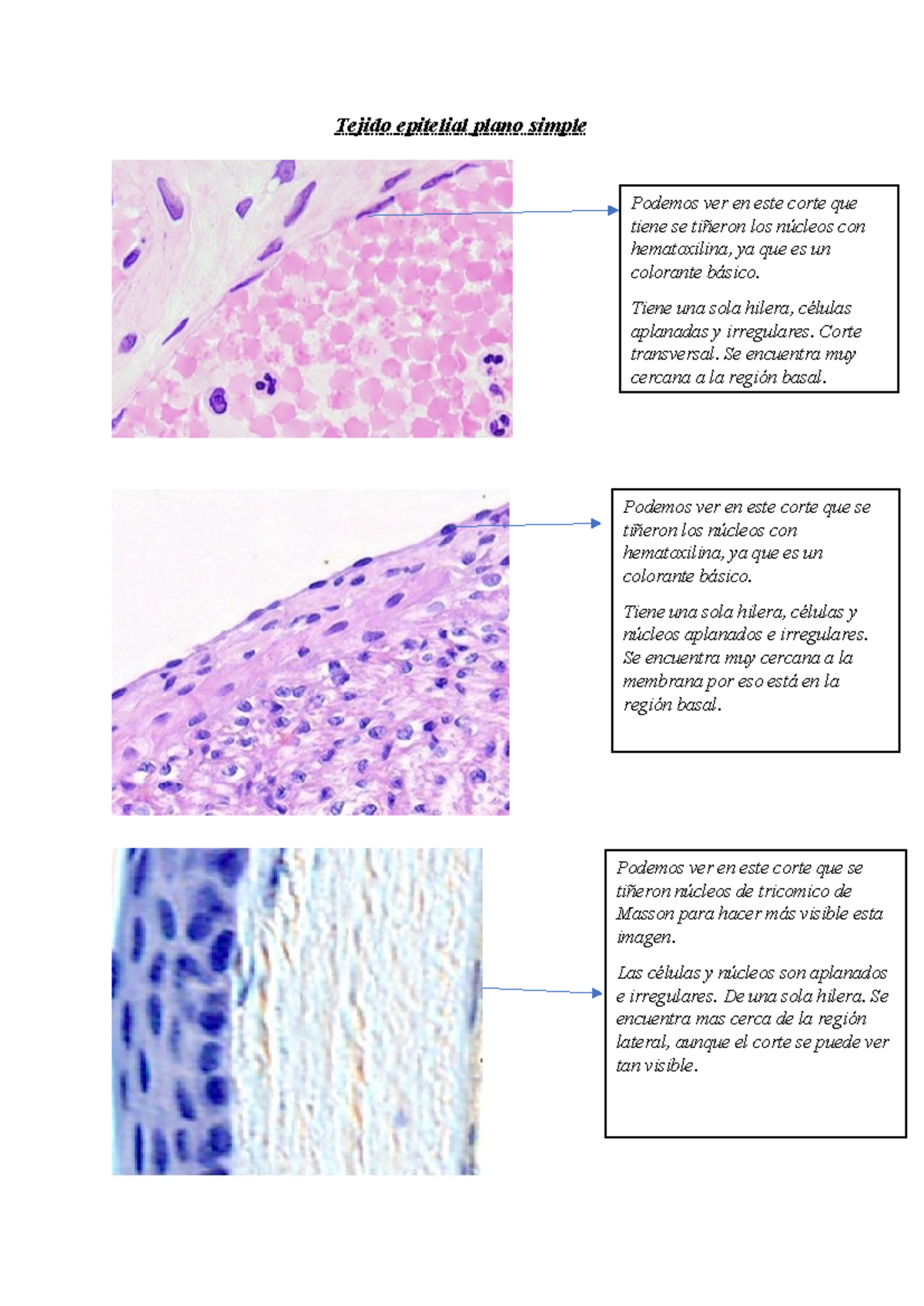 Tejido epitelial. Tarea - Tejido epitelial plano simple Podemos ver en ...