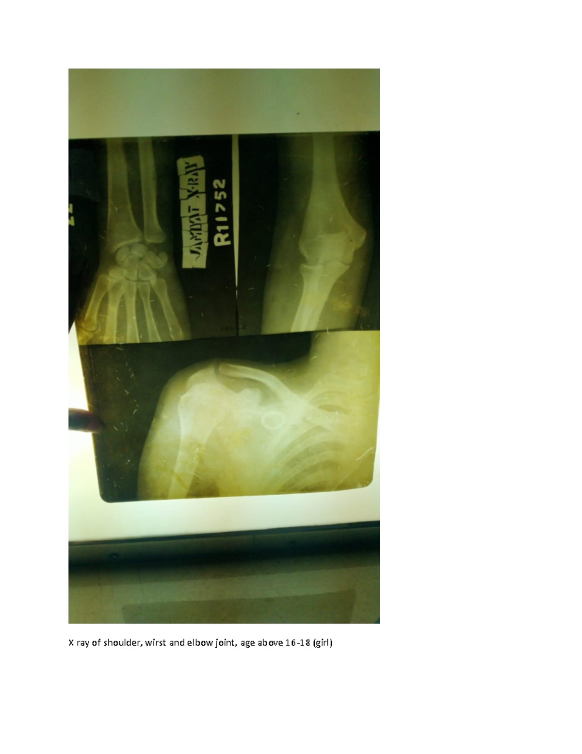 Forensics Slides - notes for MBBS - X ray of shoulder, wirst and elbow ...