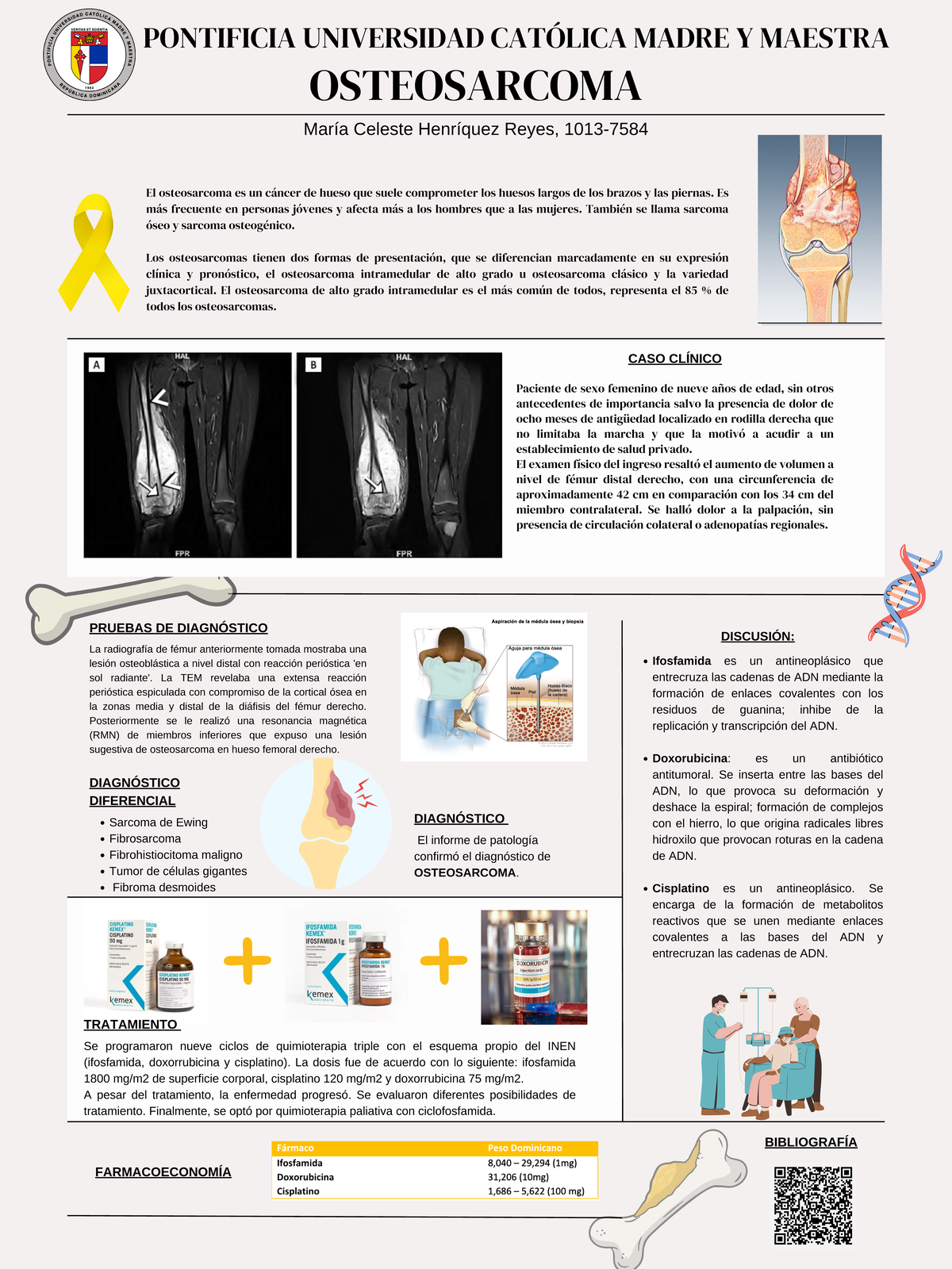 Osteosarcoma Póster - El osteosarcoma es un cáncer de hueso que suele ...