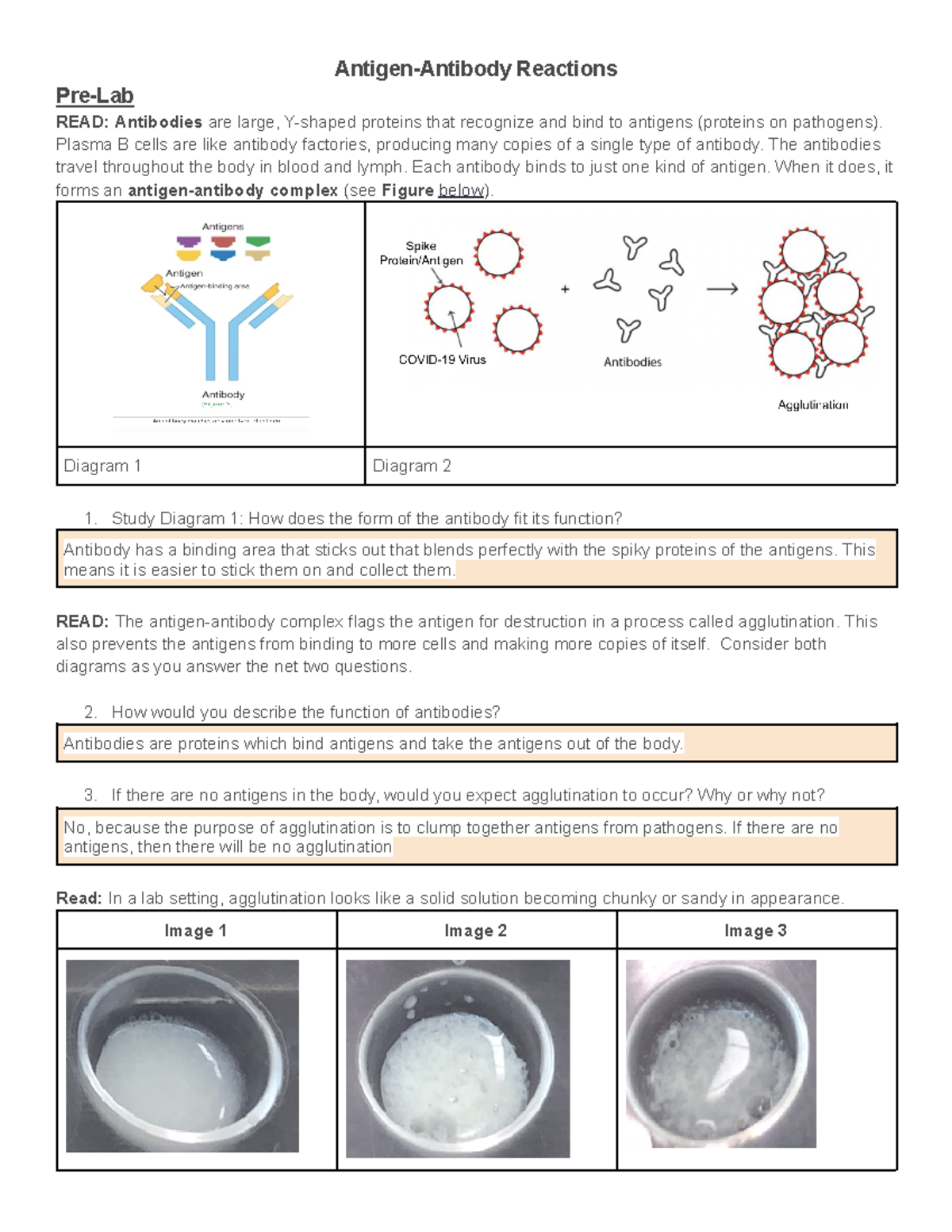 Antigen lab - 2023 Semester 1 grade 9 Biology high school notes fuhsd ...