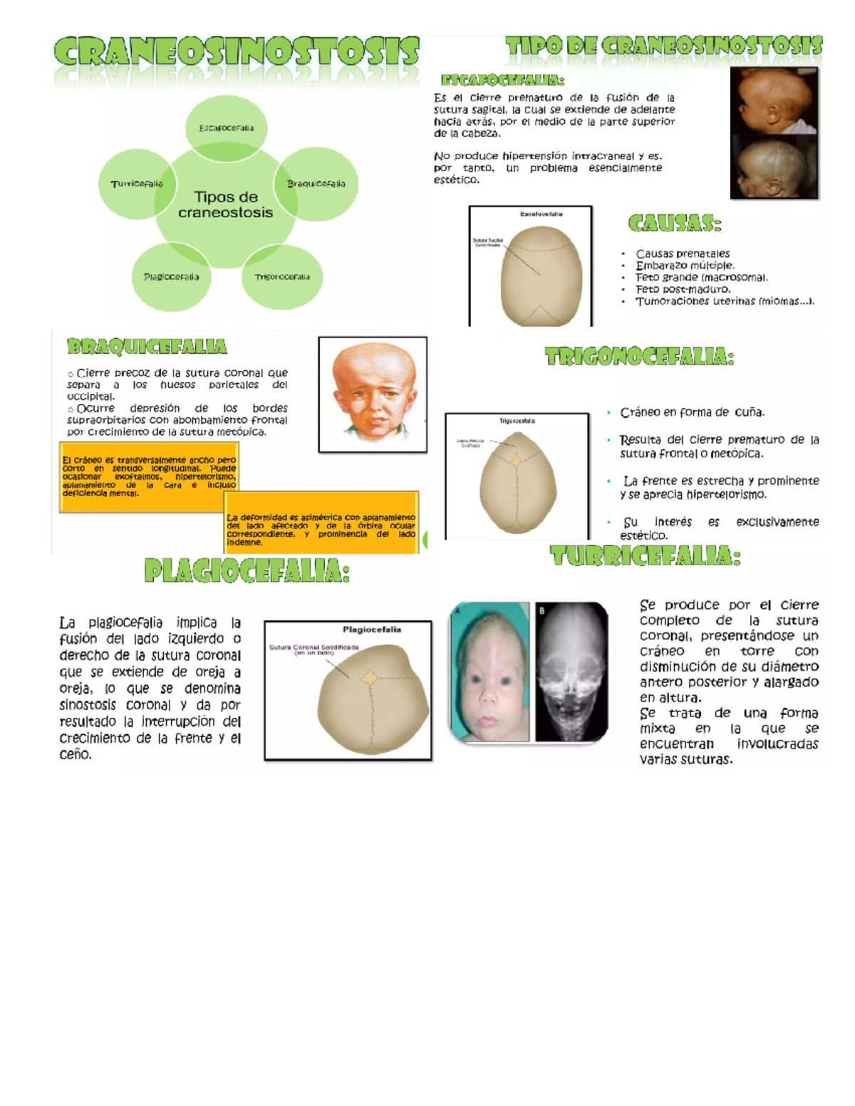 Glioblastomas multiforme - CRANEOSINOSTOST TIPOL CRANEOSINOSTOSIS CKb ...