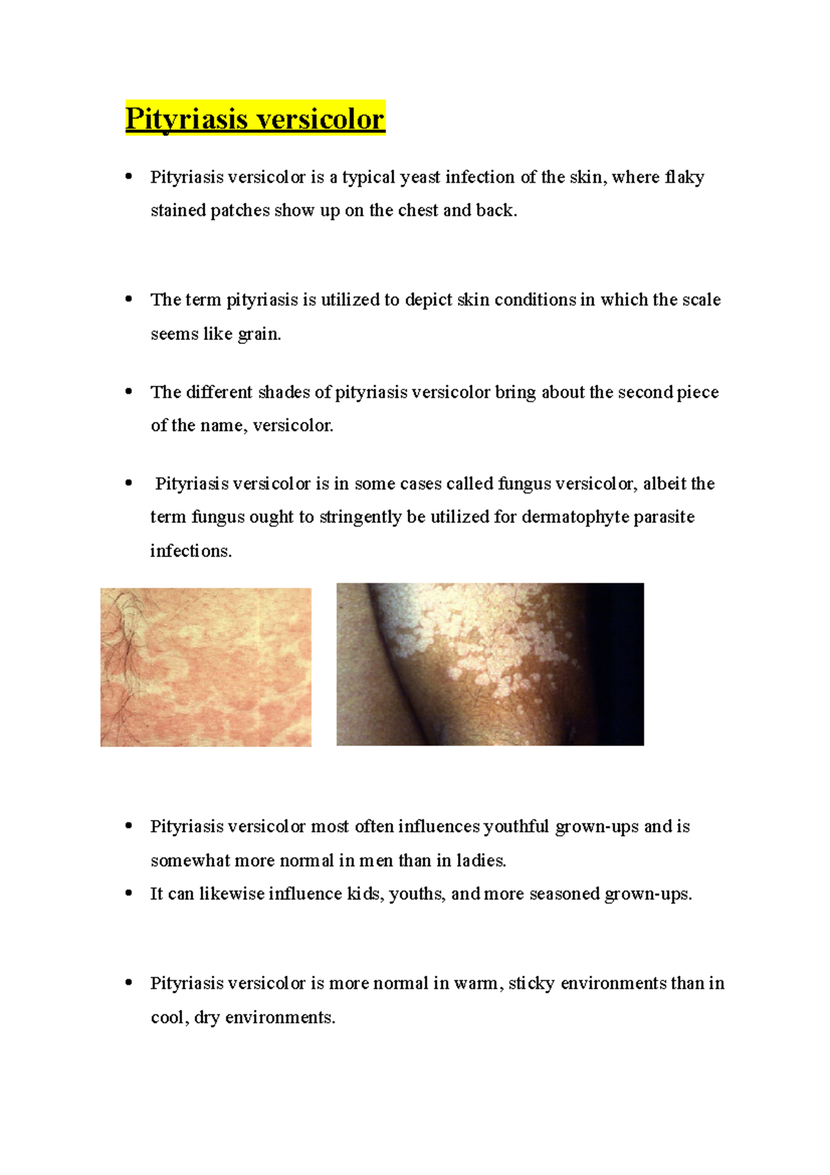 Pityriasis versicolor - The term pityriasis is utilized to depict skin ...