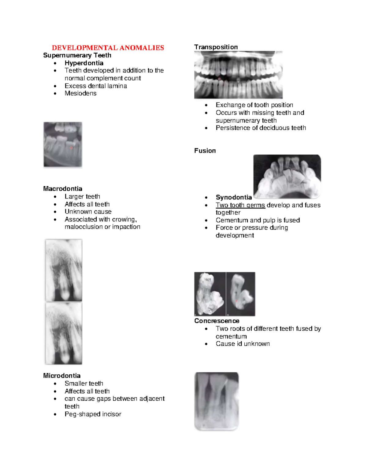 Developmental Anomalies - DEVELOPMENTAL ANOMALIES Supernumerary Teeth ...