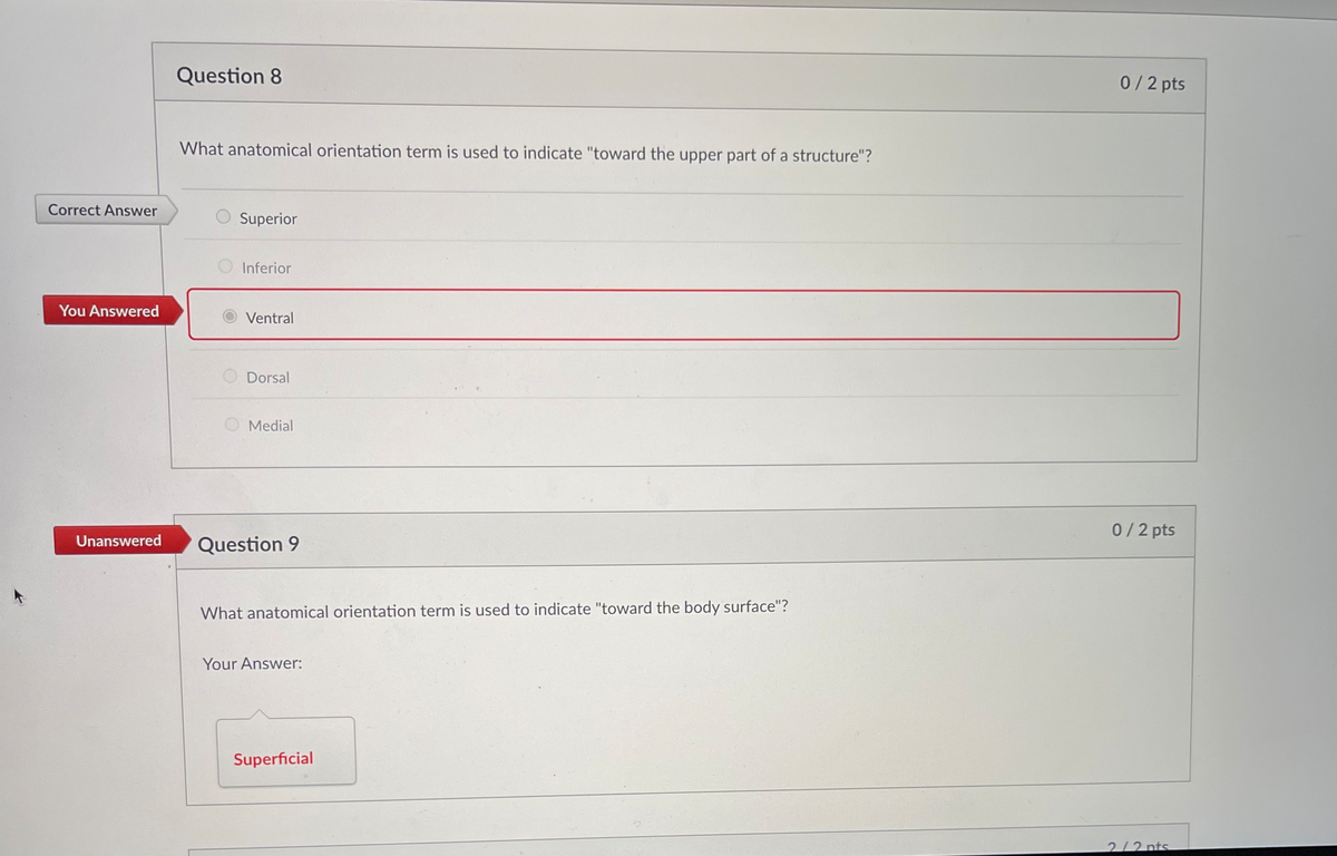 Portage Learning A & P 1 Exam 1 - Question 8 pts What anatomical ...