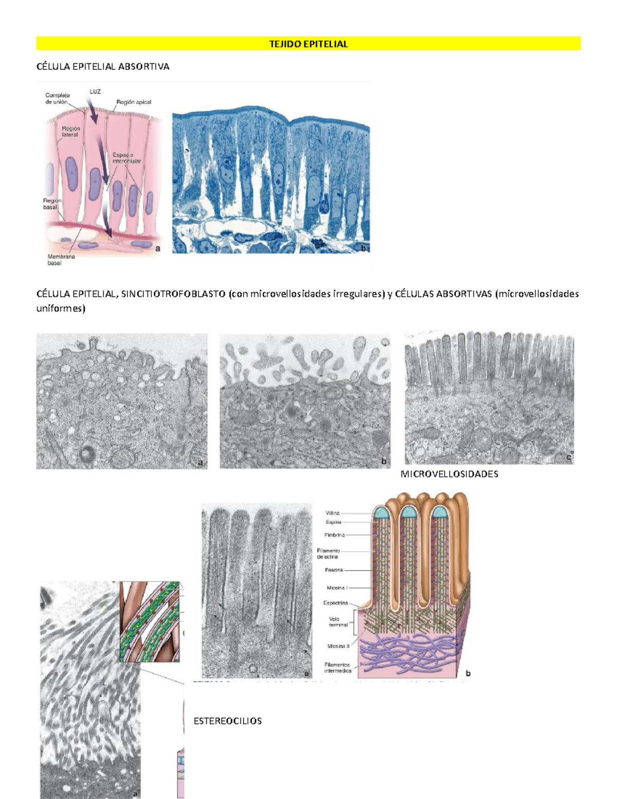 Tejido Conjuntivo LAXO Y Denso Irregular - TEJIDO EPITELIAL CÉLULA ...