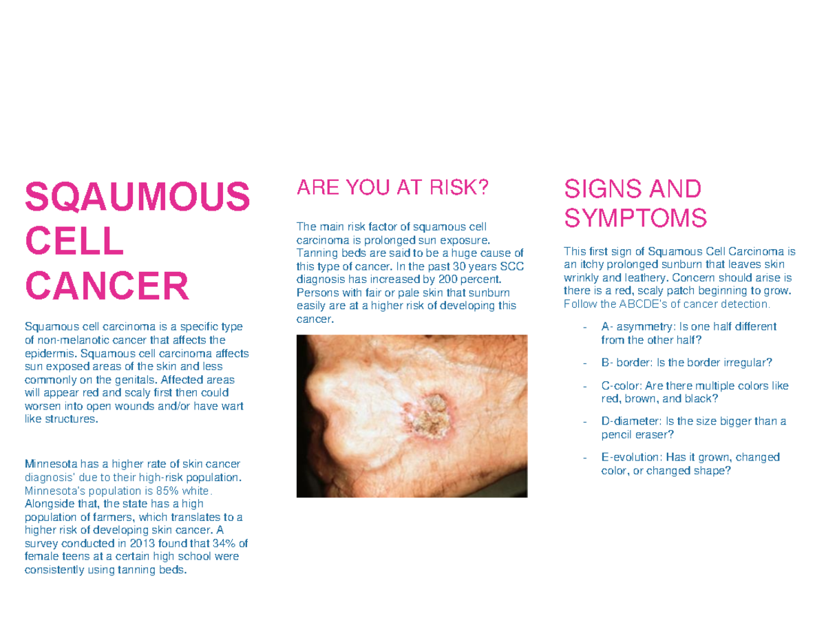 Squamous Cell Cancer Brochure - SQAUMOUS CELL CANCER Squamous cell ...