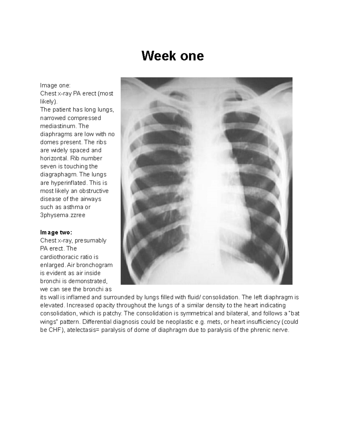 Worksheets for Boris - pathology excercise - Week one Image one: Chest ...