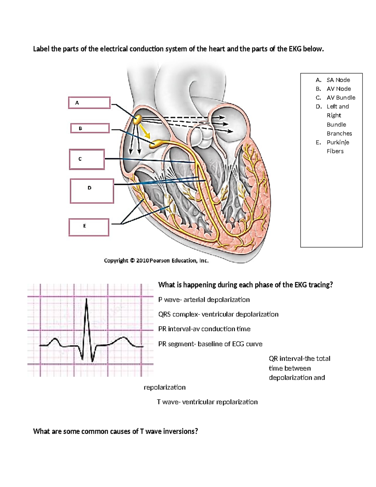 EKG lab worksheet Week 2 assignment - Label the parts of the electrical conduction system of the ...