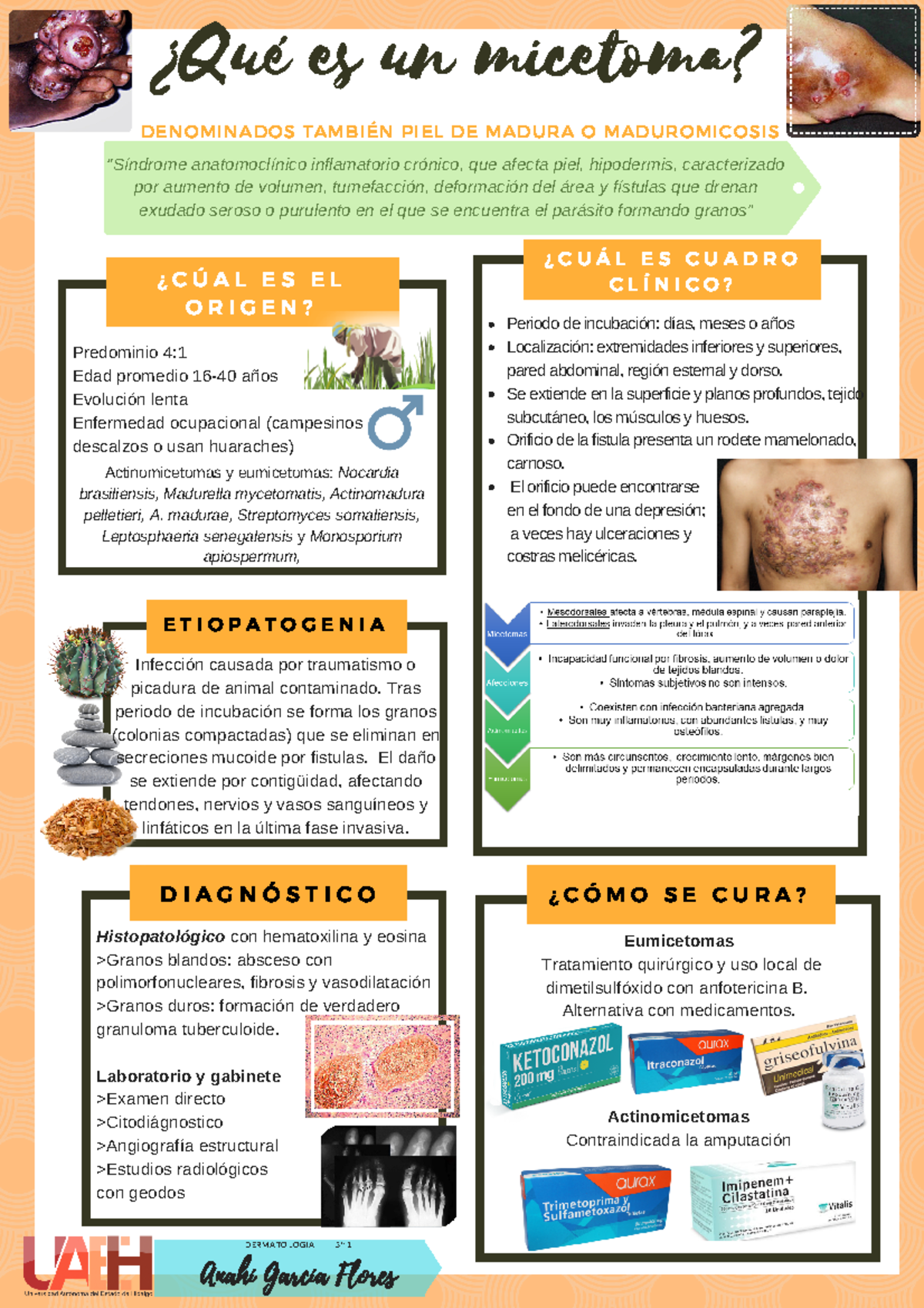 ¿Qué es un micetoma? - es un micetoma? DENOMINADOS PIEL DE MADURA O ...