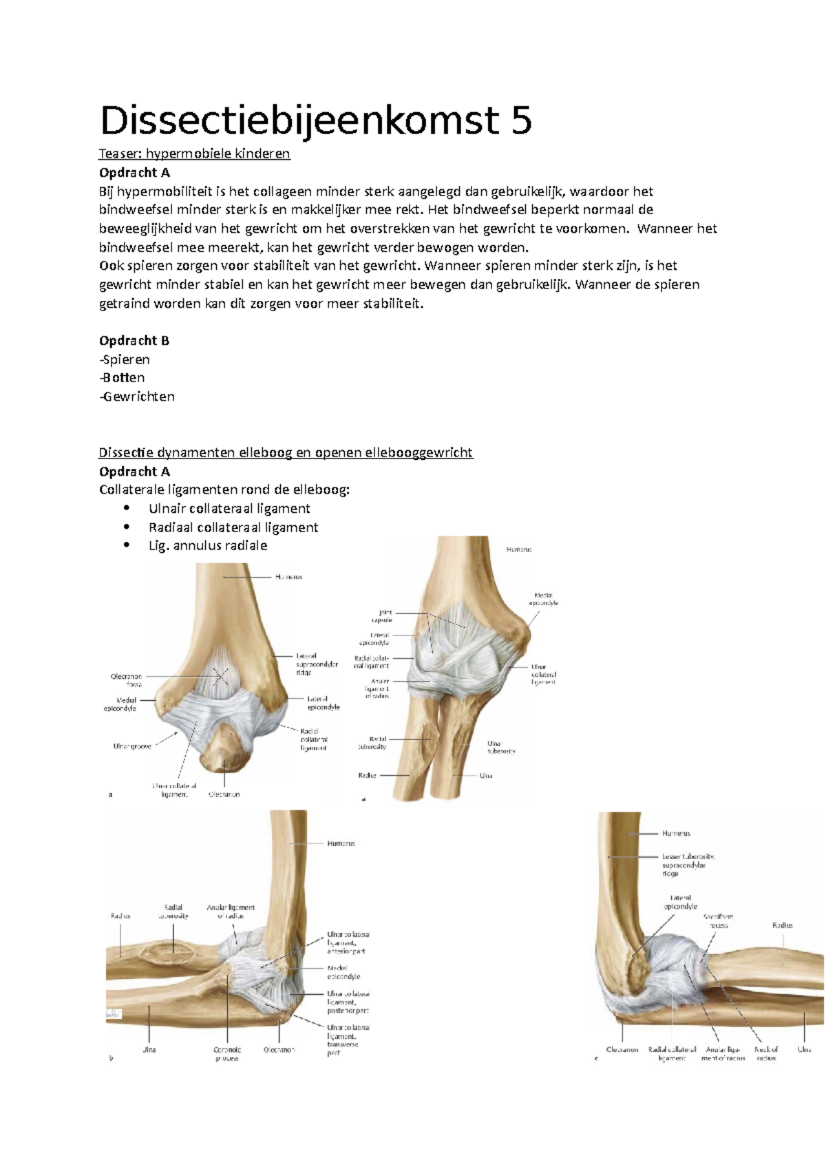 Dissectie cursus - Dissectiebijeenkomst 5 Teaser: hypermobiele kinderen ...