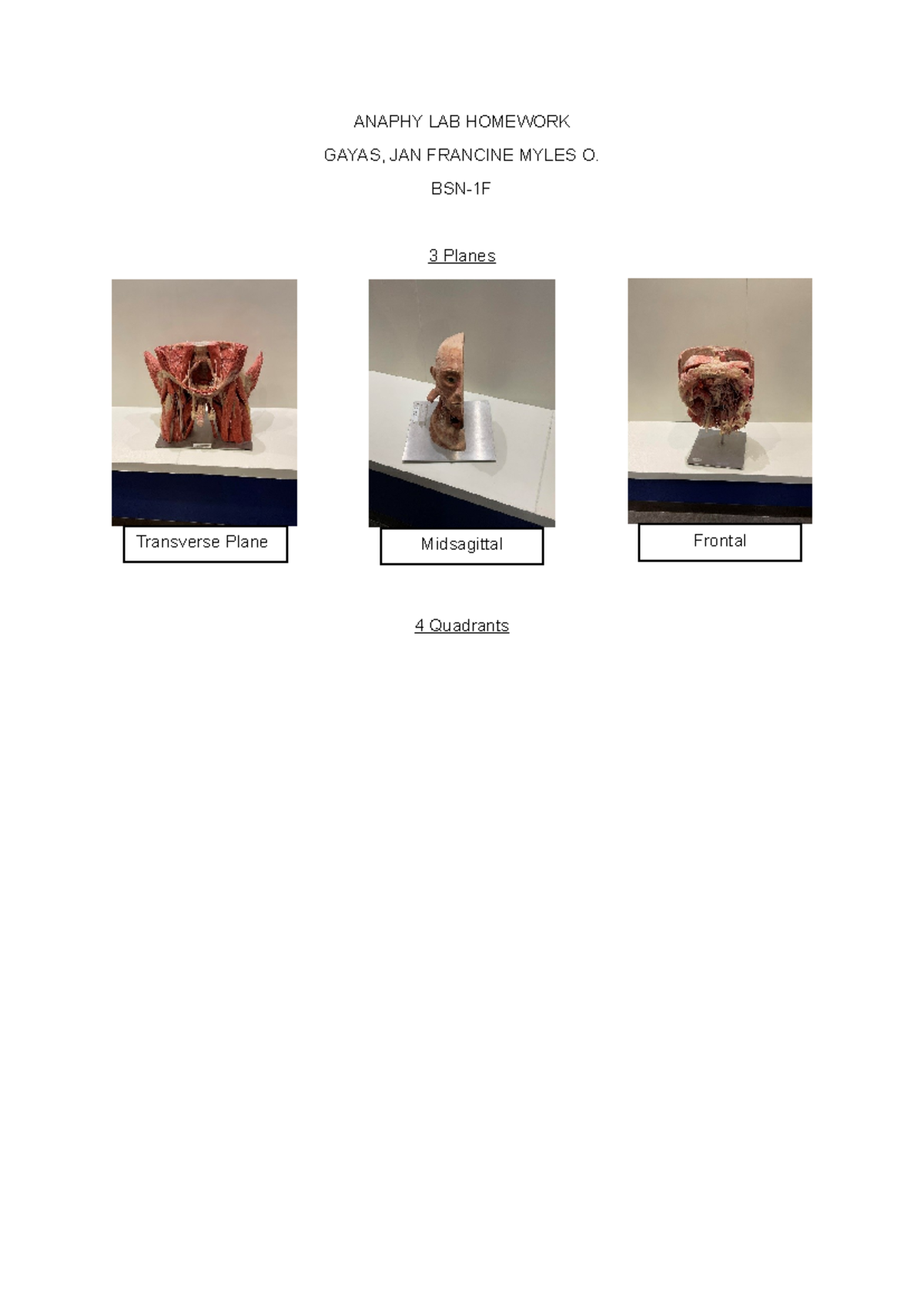 Anaphy LAB Homework - Anatomy and Physilogy - ANAPHY LAB HOMEWORK GAYAS ...
