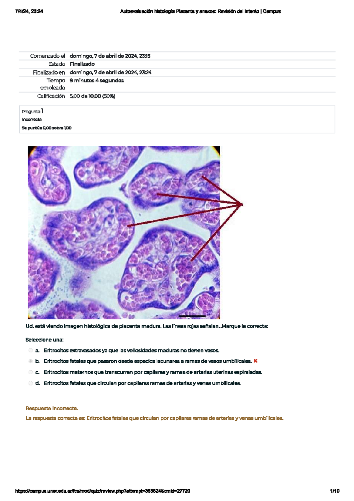 Autoev histo up3 - aaaa - Sexualidad Genero y Reproduccion - Studocu