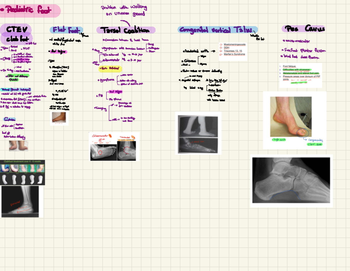 O Pediatric Hip & Foot - Foor abnormalities - : E : · o e 4 T D S & o ...