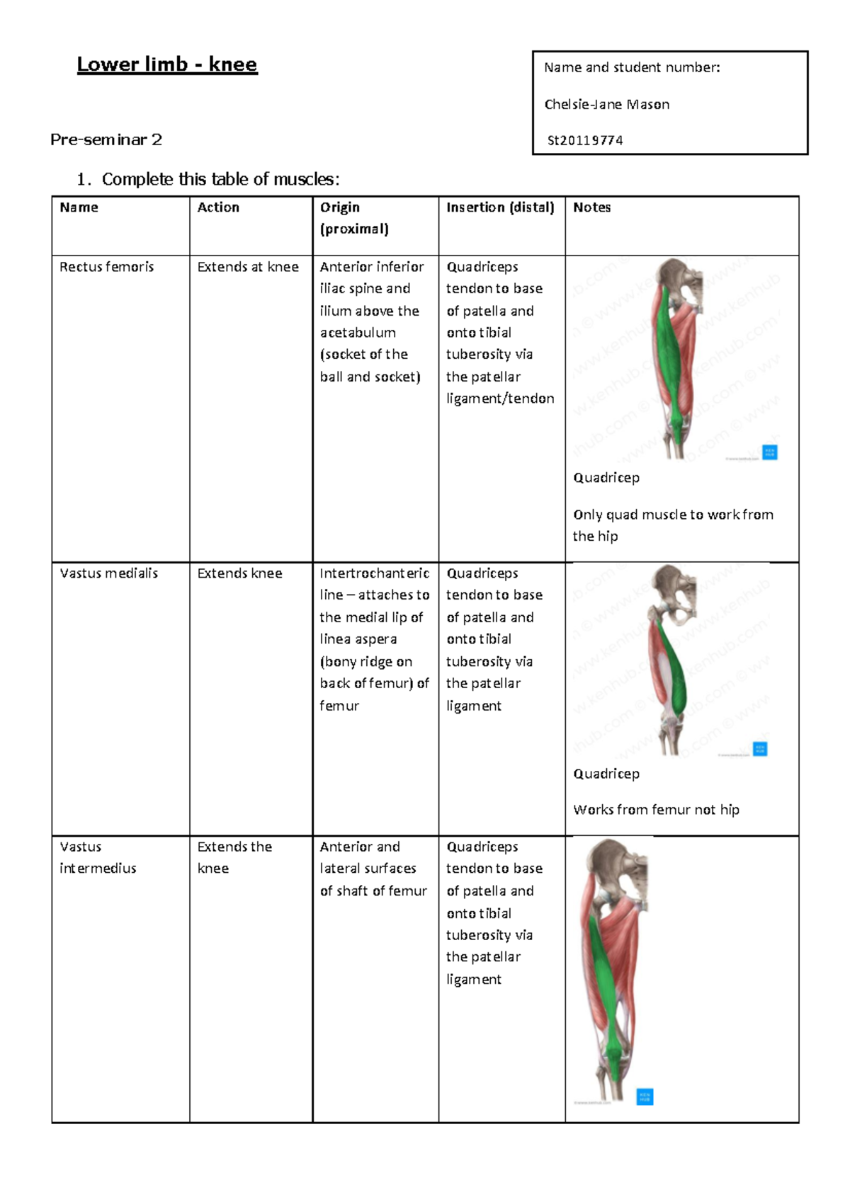 Knee 2 - Anatomy of the knee - Warning: TT: undefined function: 32 Warning: TT: undefined ...