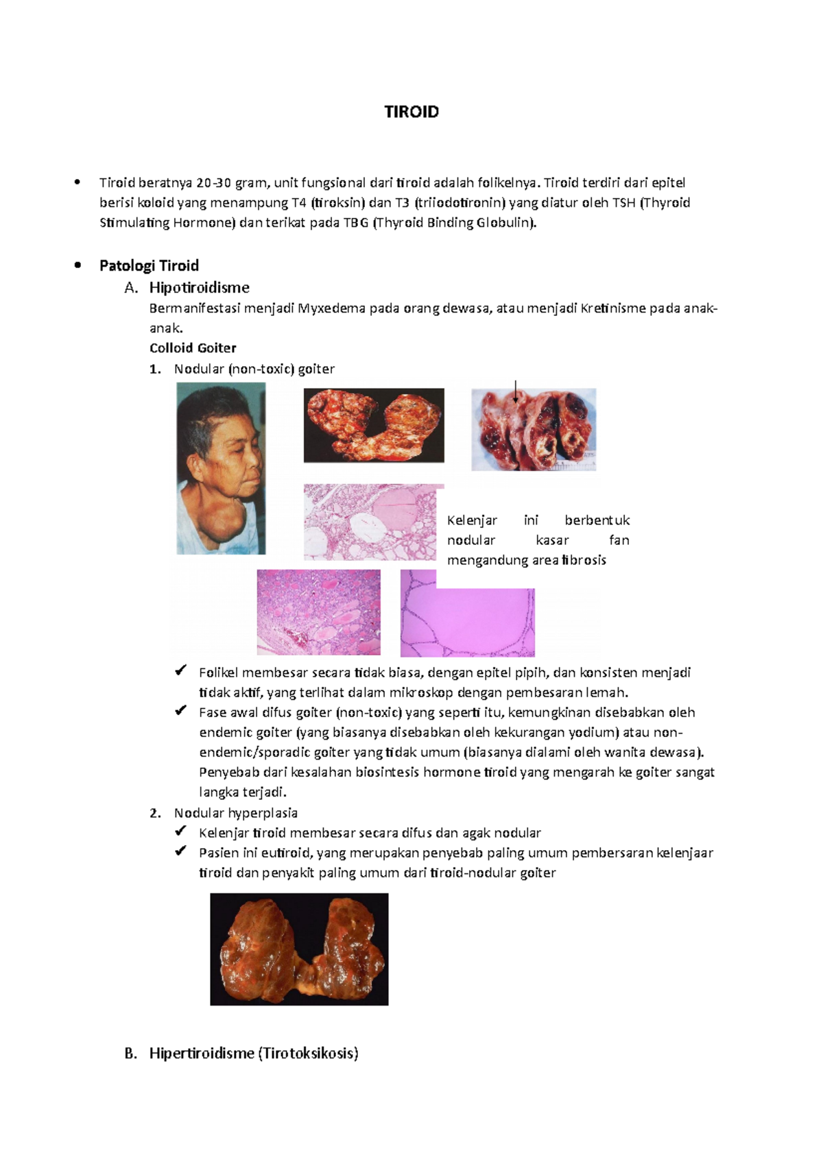 Tiroid - Blok 12 - TIROID Tiroid beratnya 20-30 gram, unit fungsional ...
